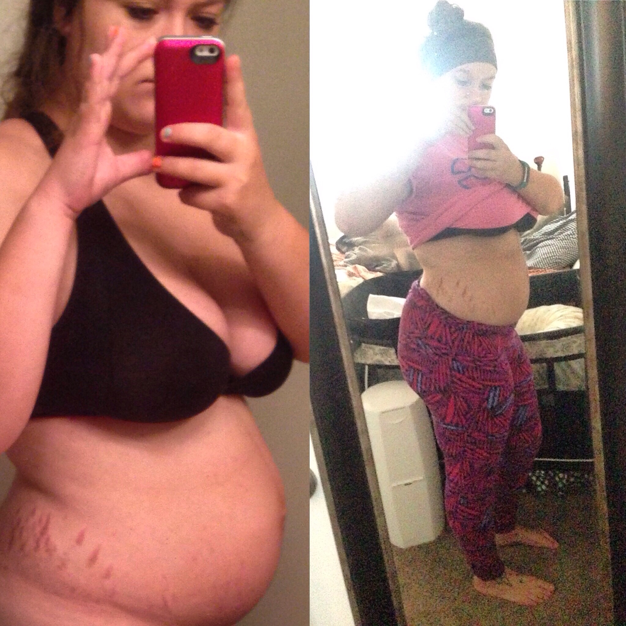 1 day postpartum--->2 weeks postpartum | Scrolller