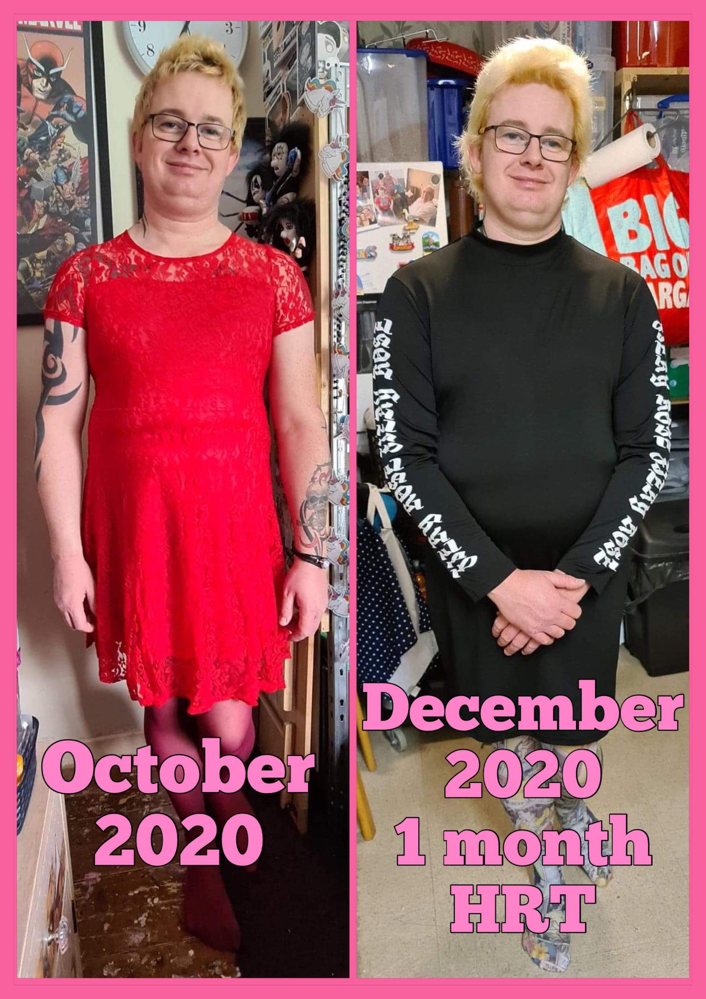 1 month before starting hrt to 1 month on hrt | Scrolller