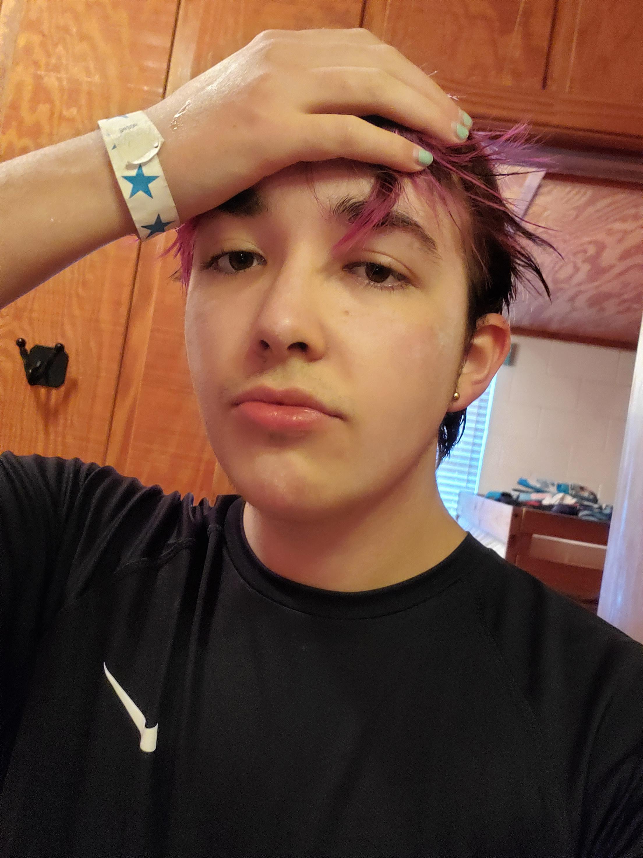 1+ year on T / 7 months post op (top) | Scrolller