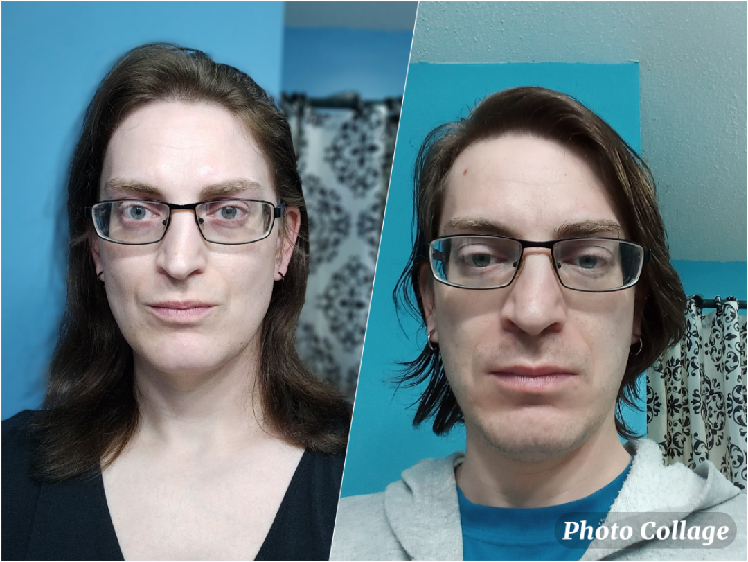 10 months vs day 1 (35 y/o mtf) | Scrolller