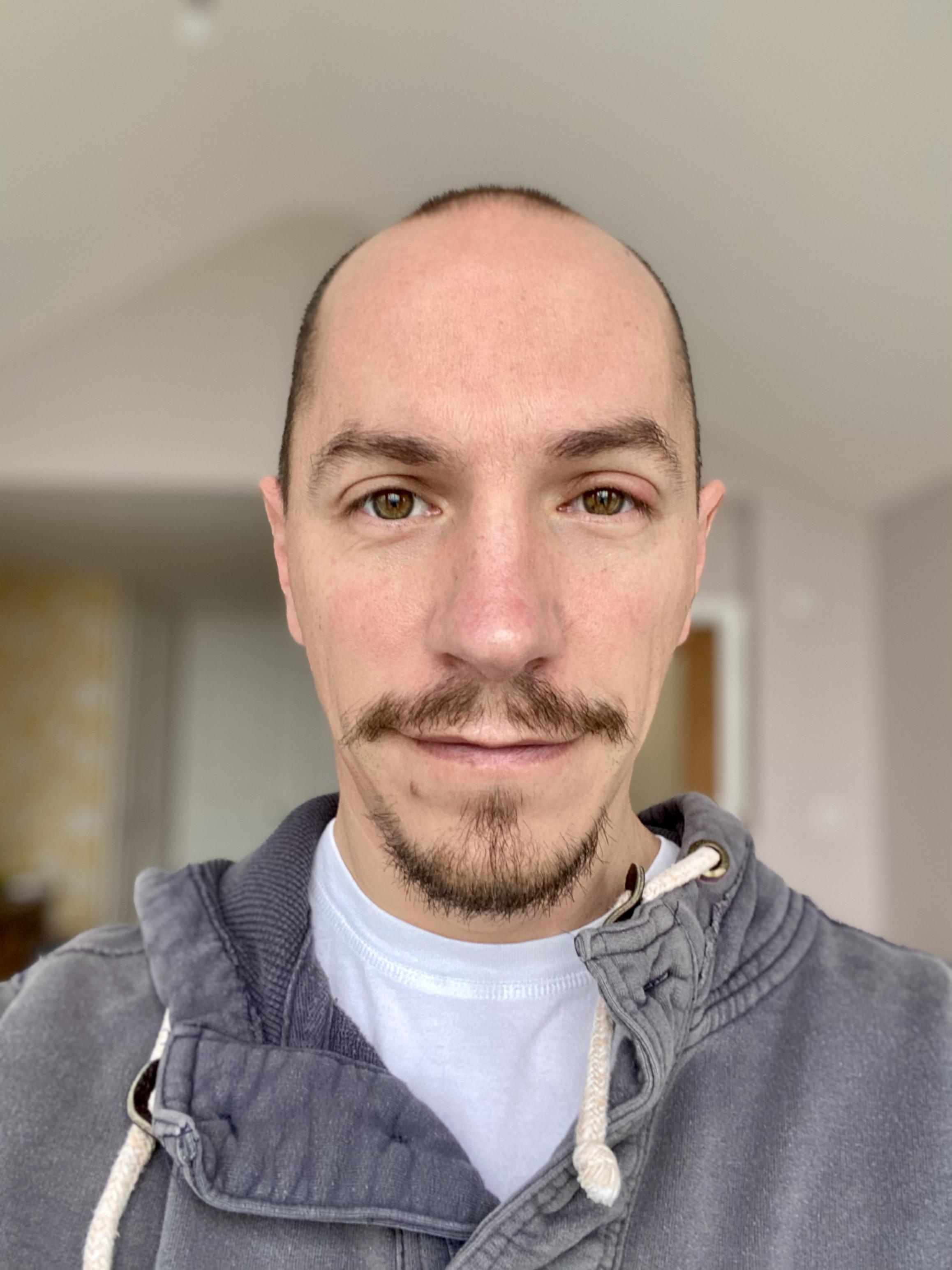 1st-moustache-5-weeks-in-advice-needed-scrolller