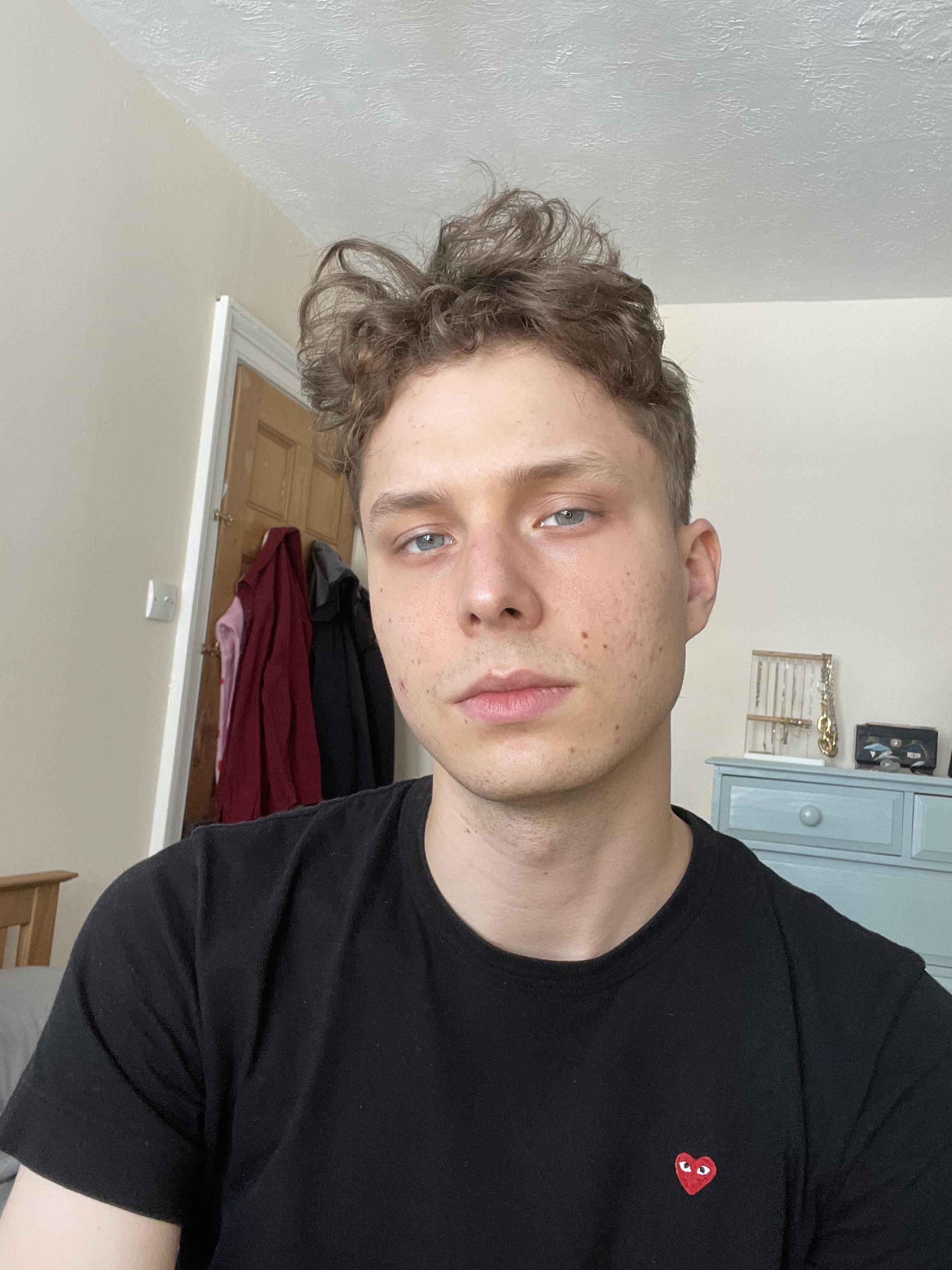 [22] Been told I have a nice chin. What you think? 😉 | Scrolller