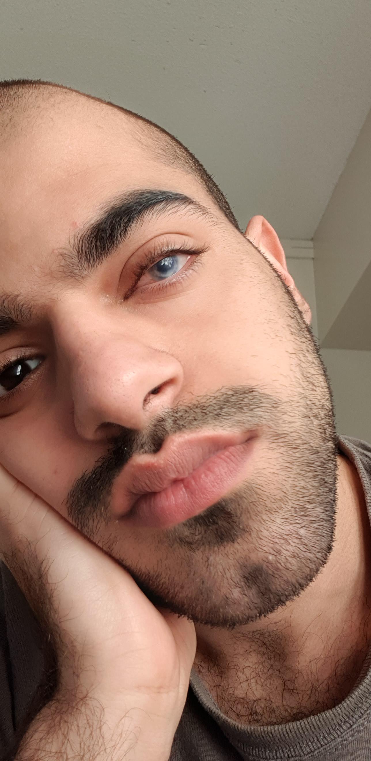 24 M - its buzzcut season. (Heterochromia) | Scrolller