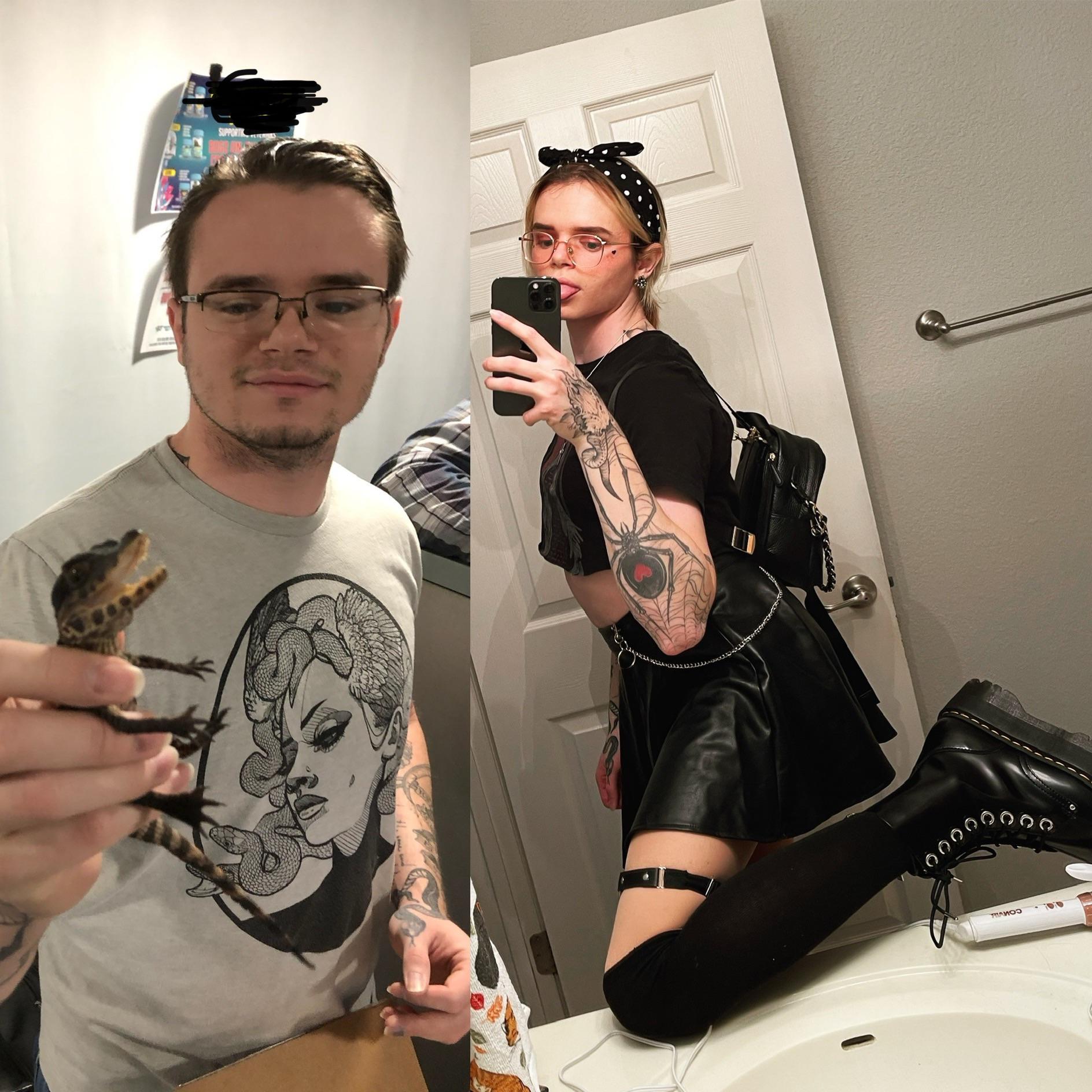 25 injections later... 😍 | Scrolller