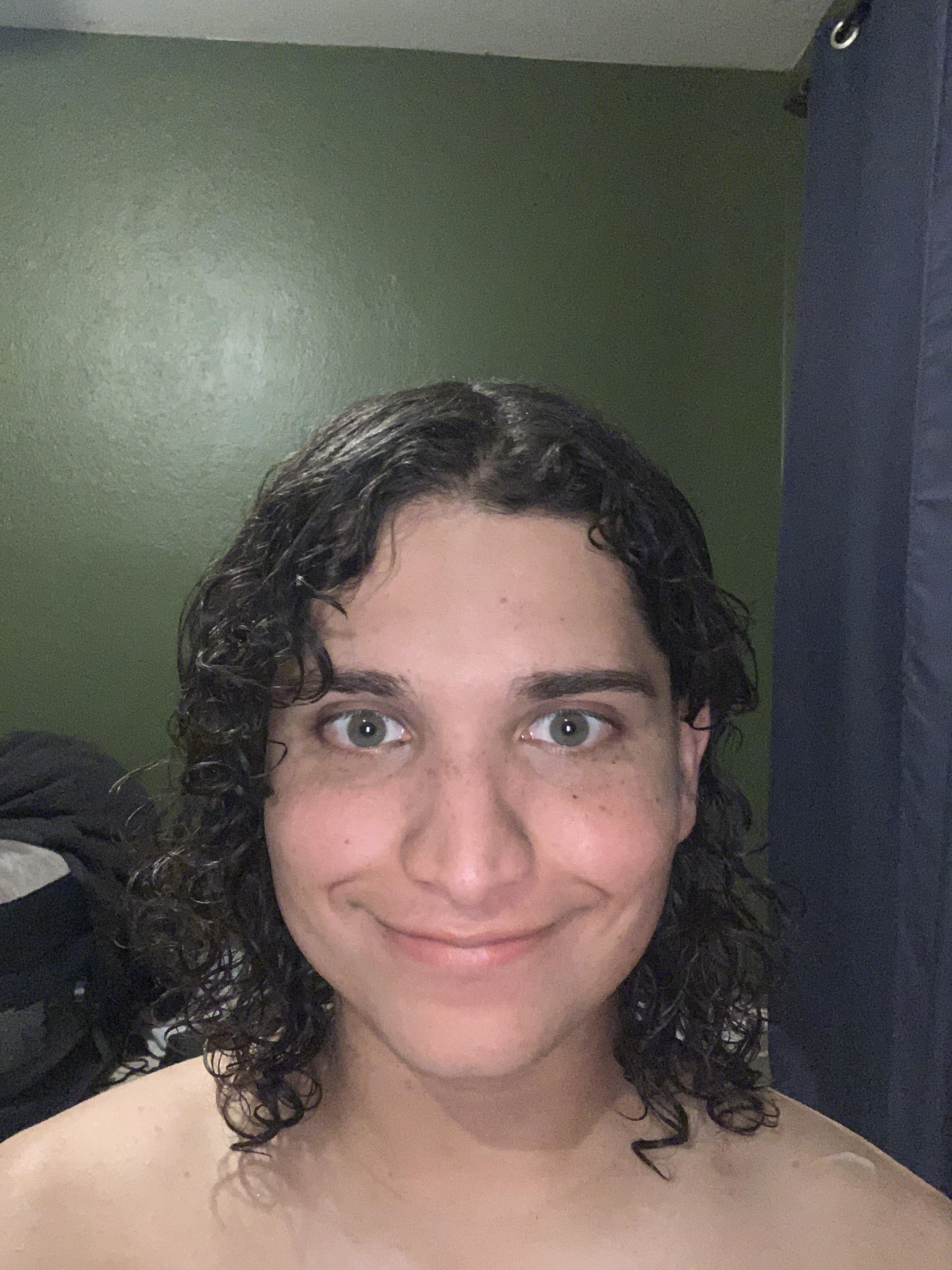 3 months on the right feeling, estrogen. What are my problems? | Scrolller