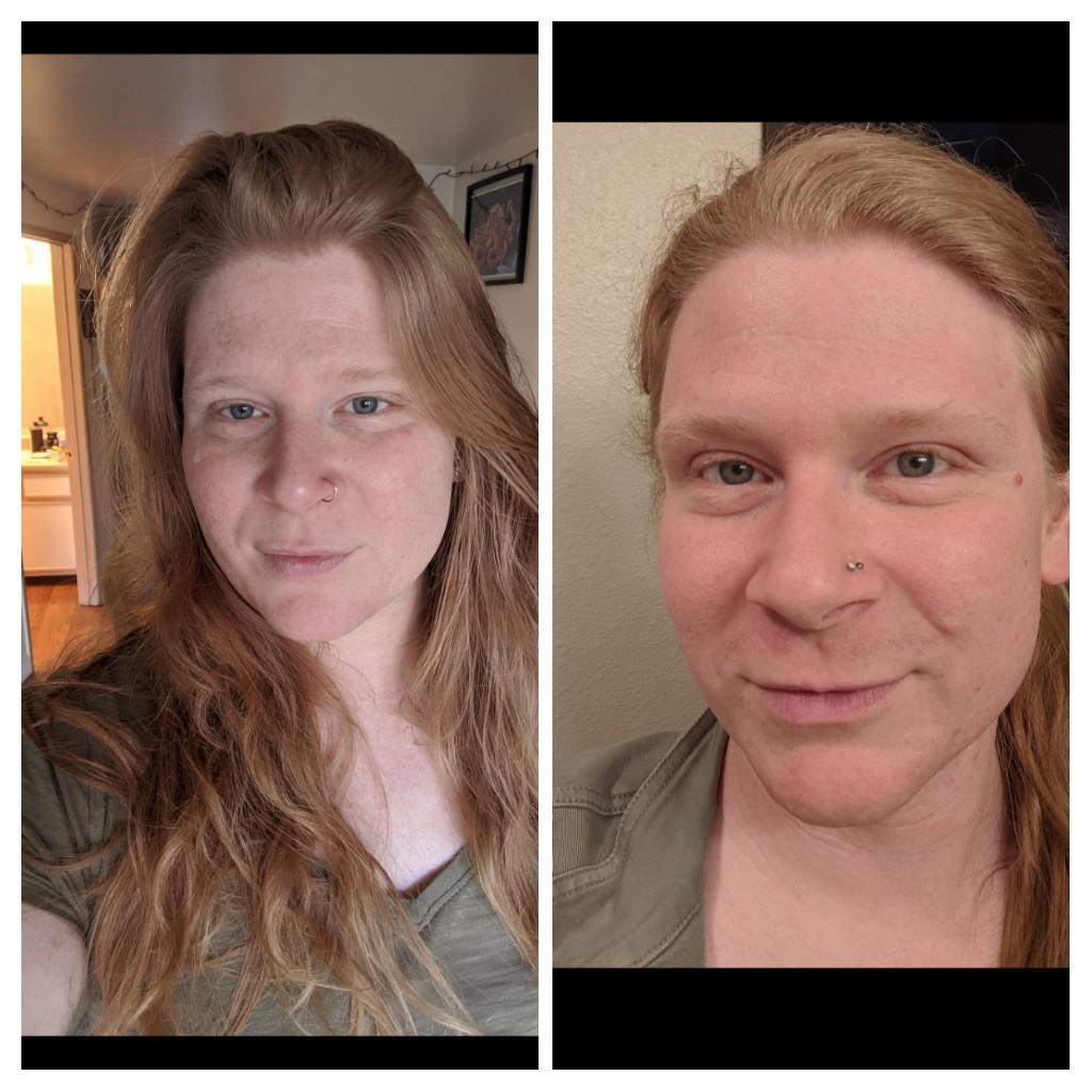 30 to 32, nearly two years hrt. It's strange that the difference can be so subtle, yet so ...
