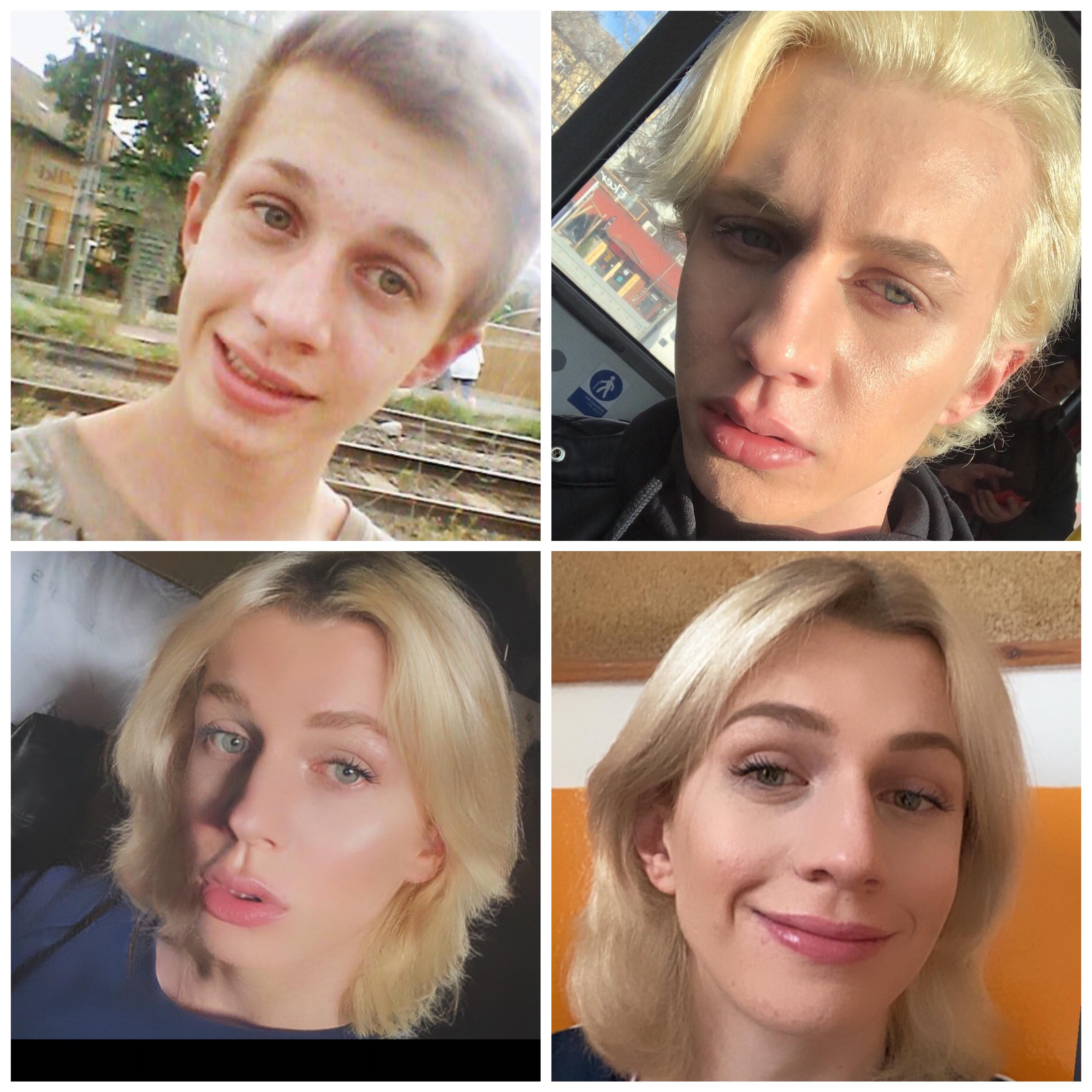 -3year to 3.Month hrt | Scrolller
