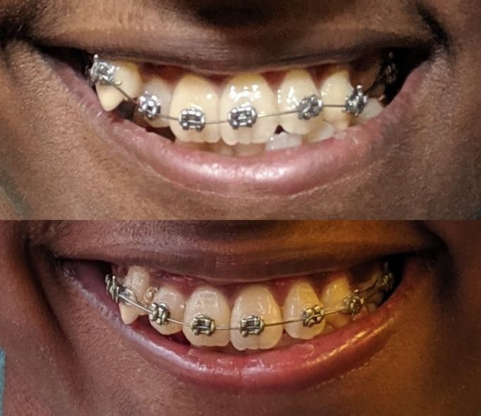 4 week update! | Scrolller