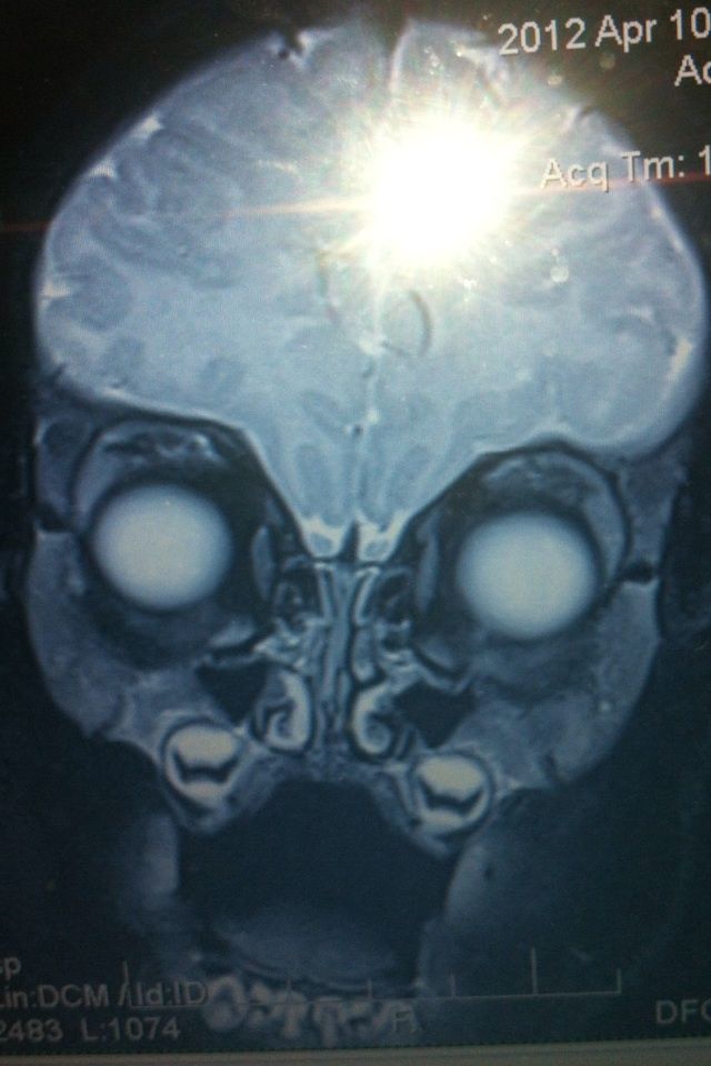 5 month old had to get an MRI. Pretty freaky pic. | Scrolller