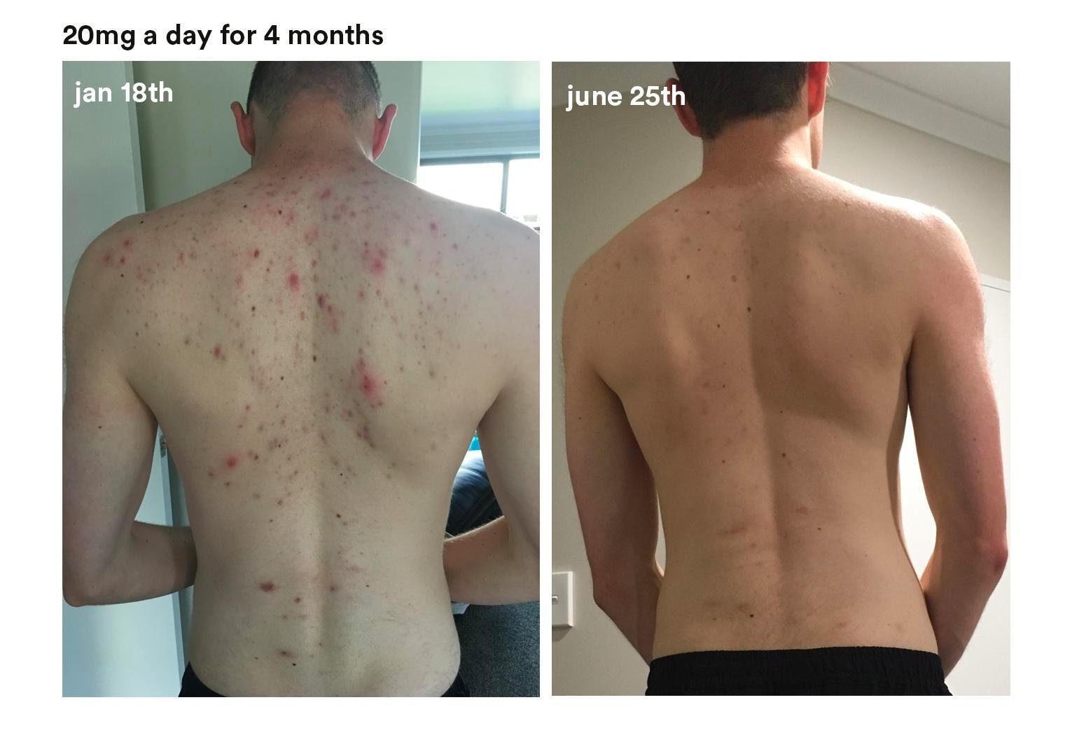 5 months later... | Scrolller