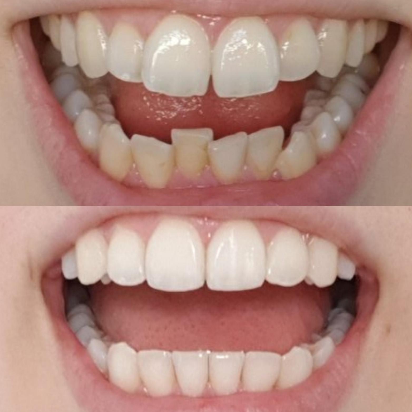 7 months and finally done ahhh!!🤠 | Scrolller