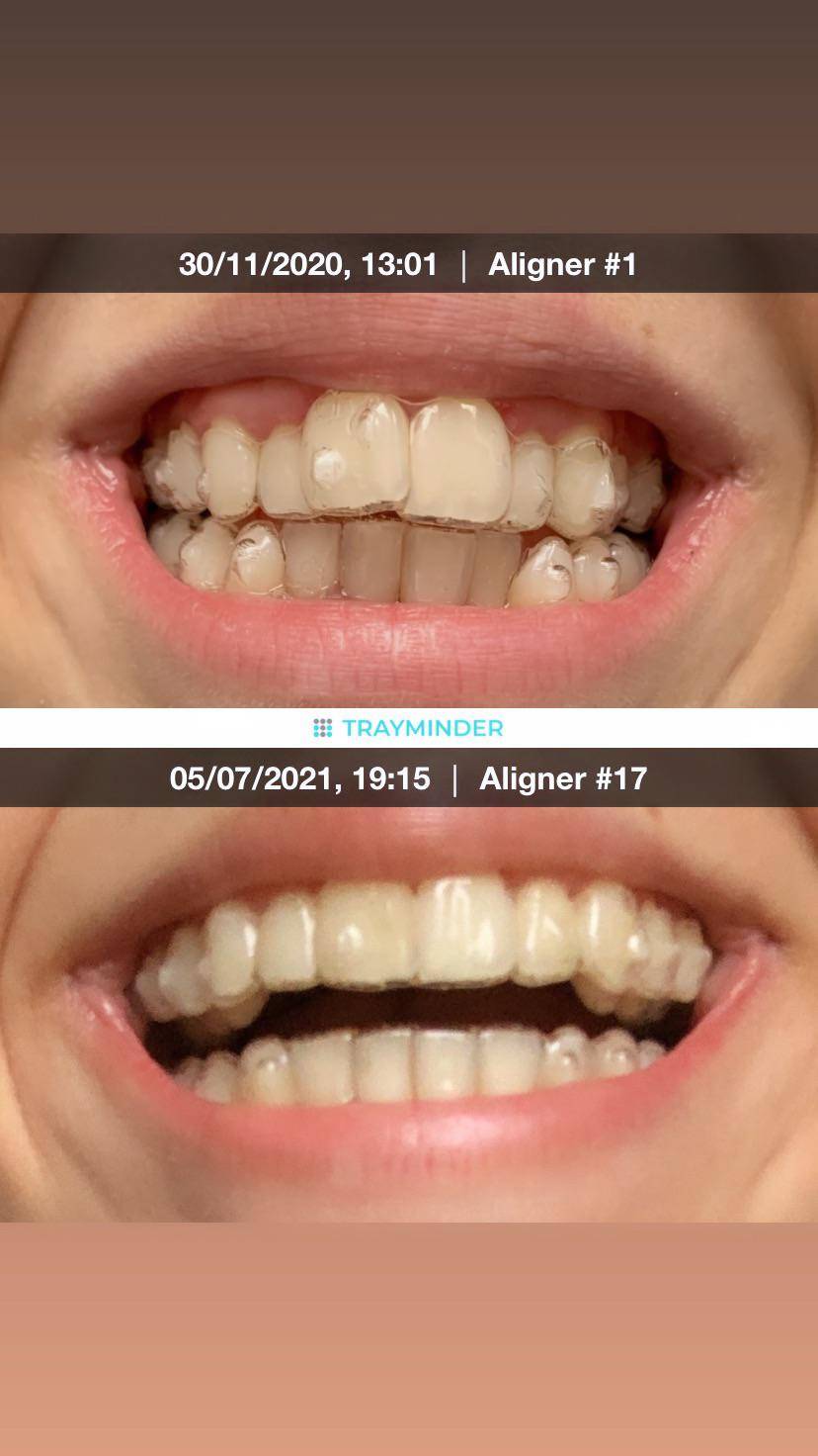 7 Months Progress. Opinions? | Scrolller