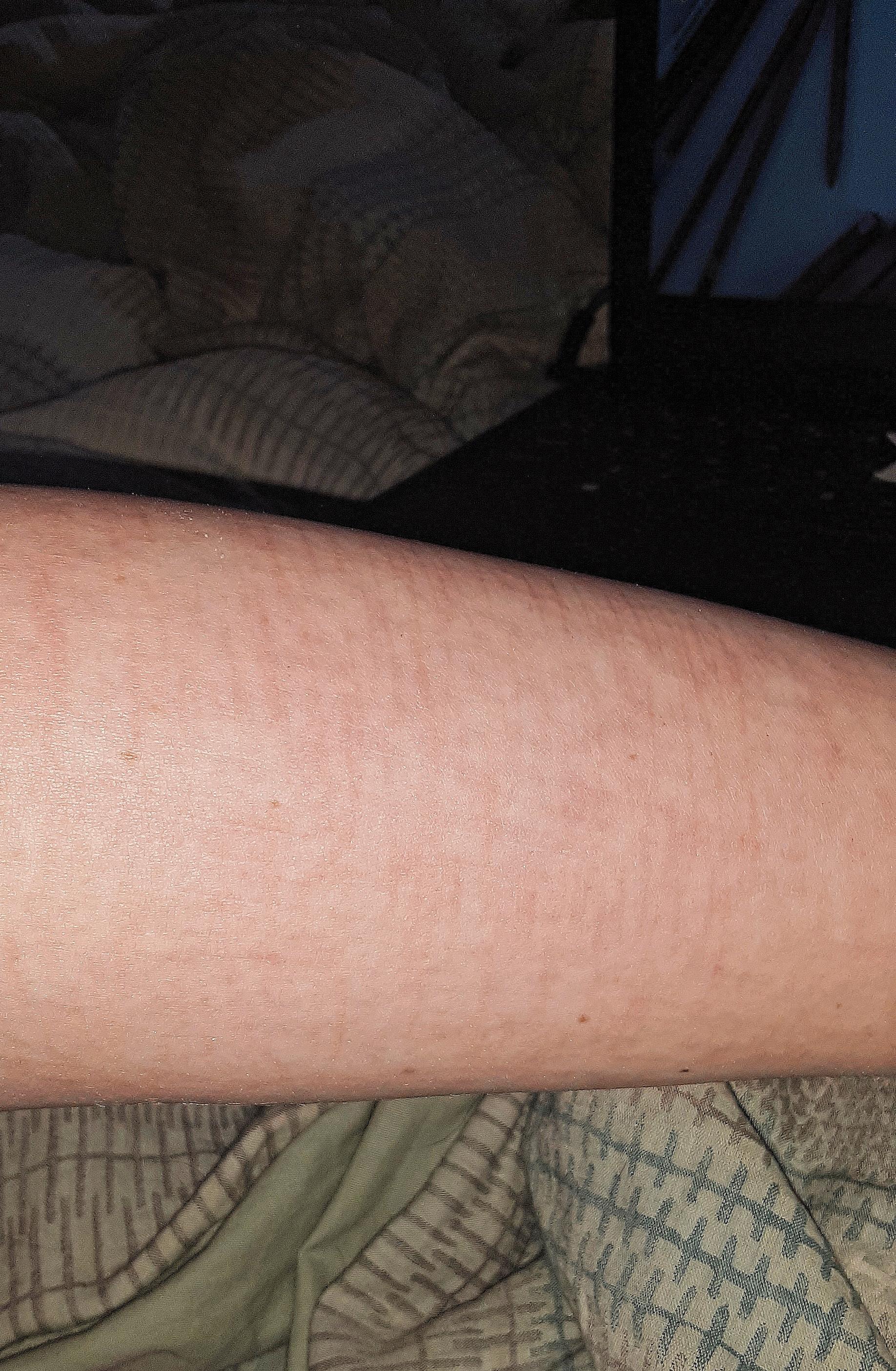 A Bunch of Old Scars | Scrolller