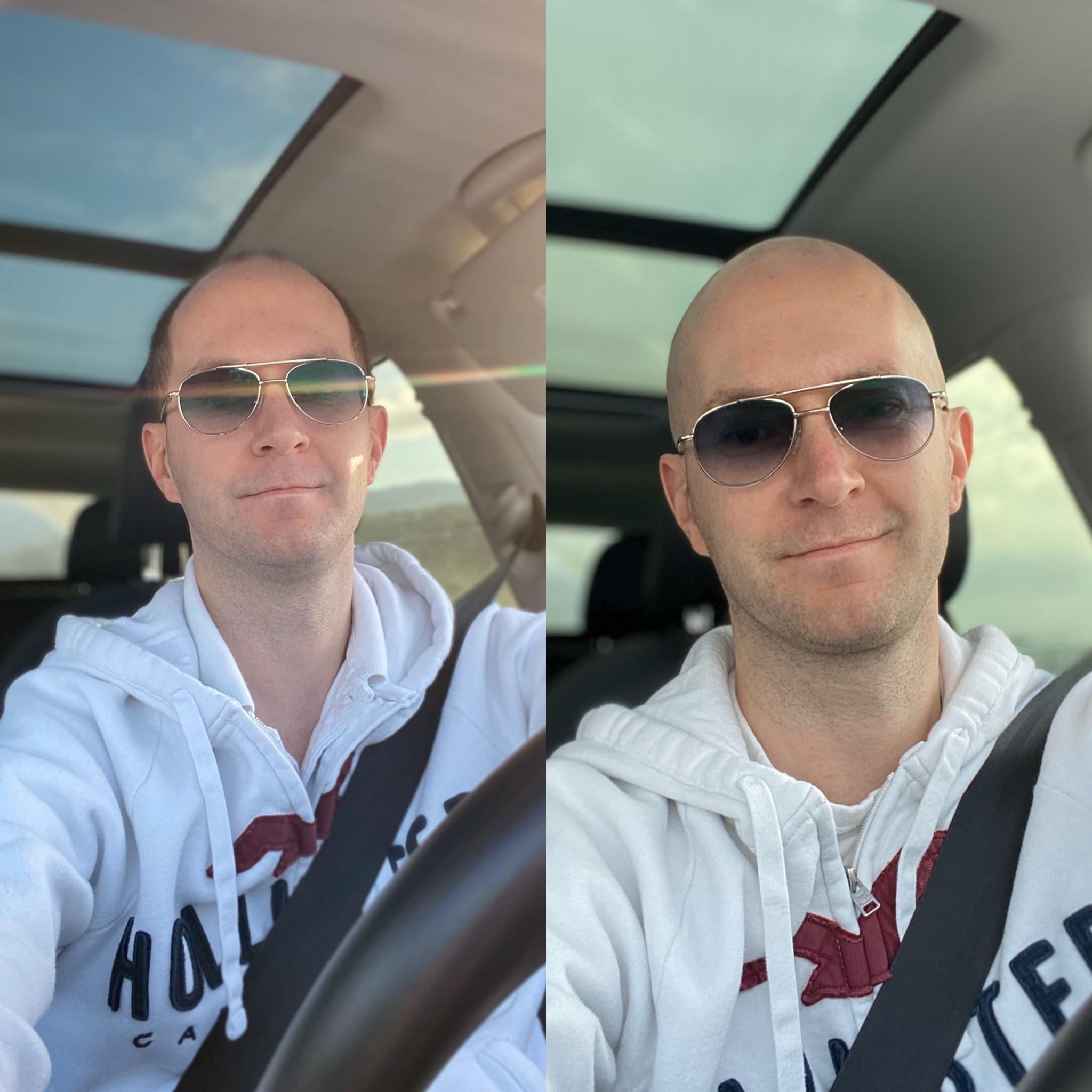 After 5 years of very thinning hair I did a thing today. I feel liberated | Scrolller