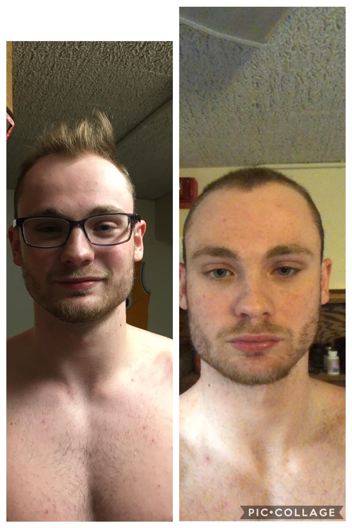 After two years of struggle, I finally pulled the trigger at 19! | Scrolller