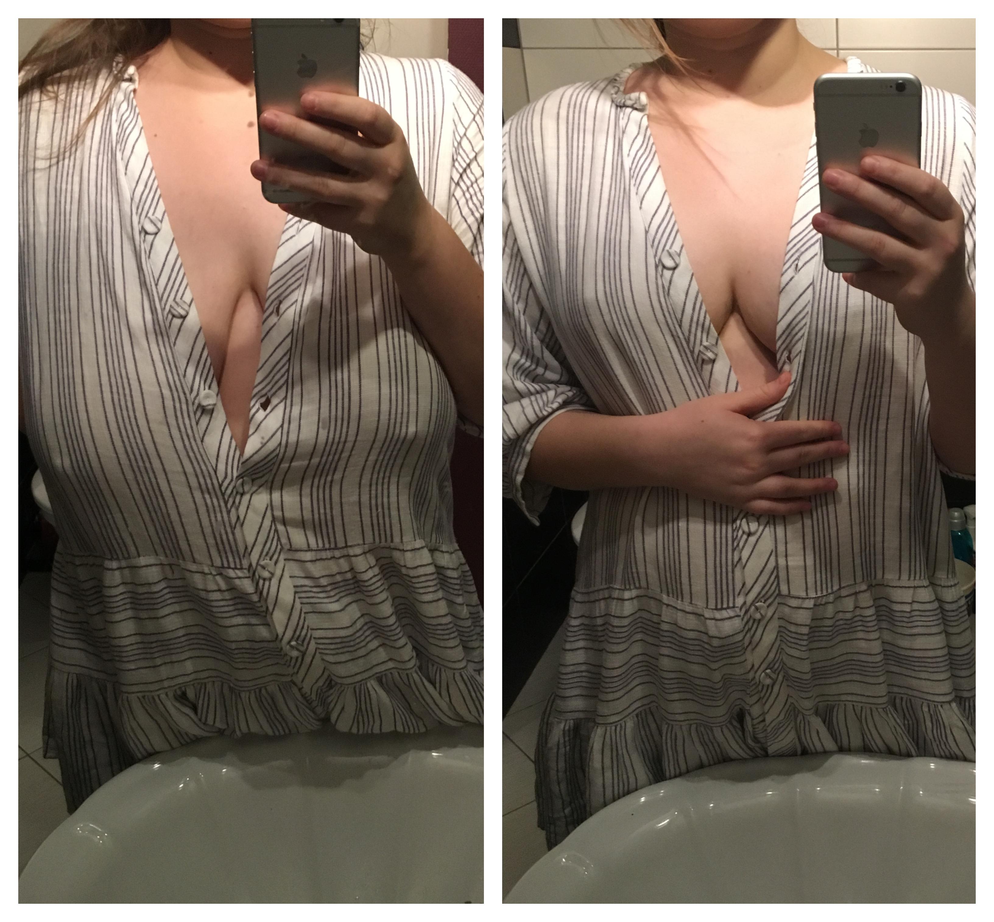 Almost a month post-op! | Scrolller