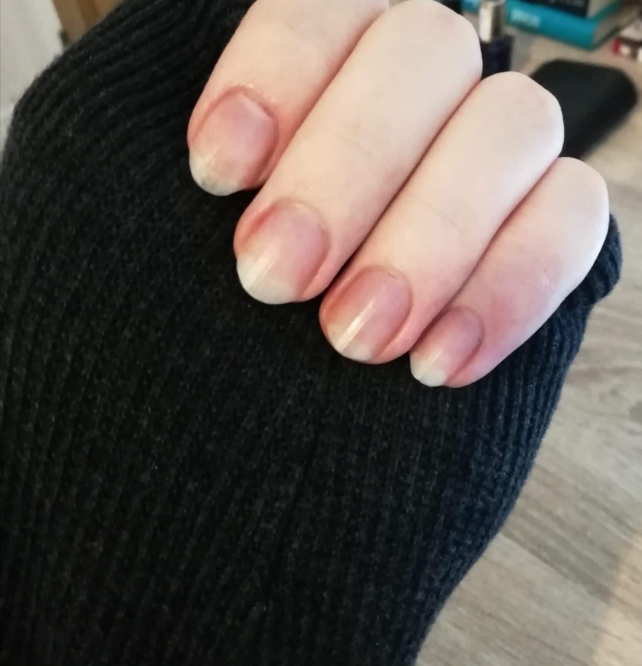 Are these long enough to start counting? | Scrolller