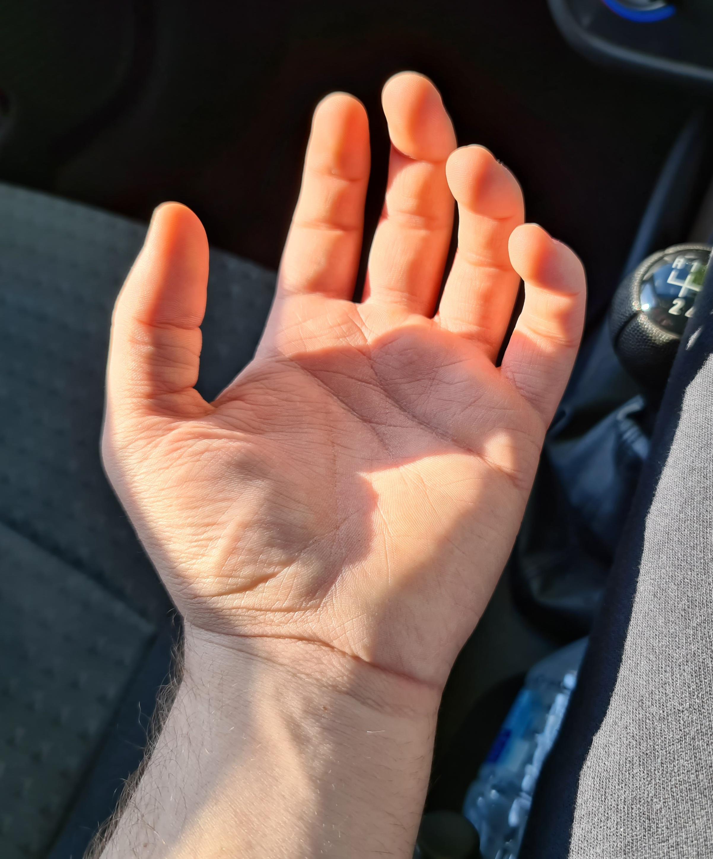 Are chunky boy hands liked here? 🙈 | Scrolller