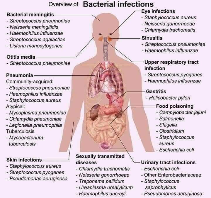 Bacterial Infections and the parts of the body they attack/start | Scrolller