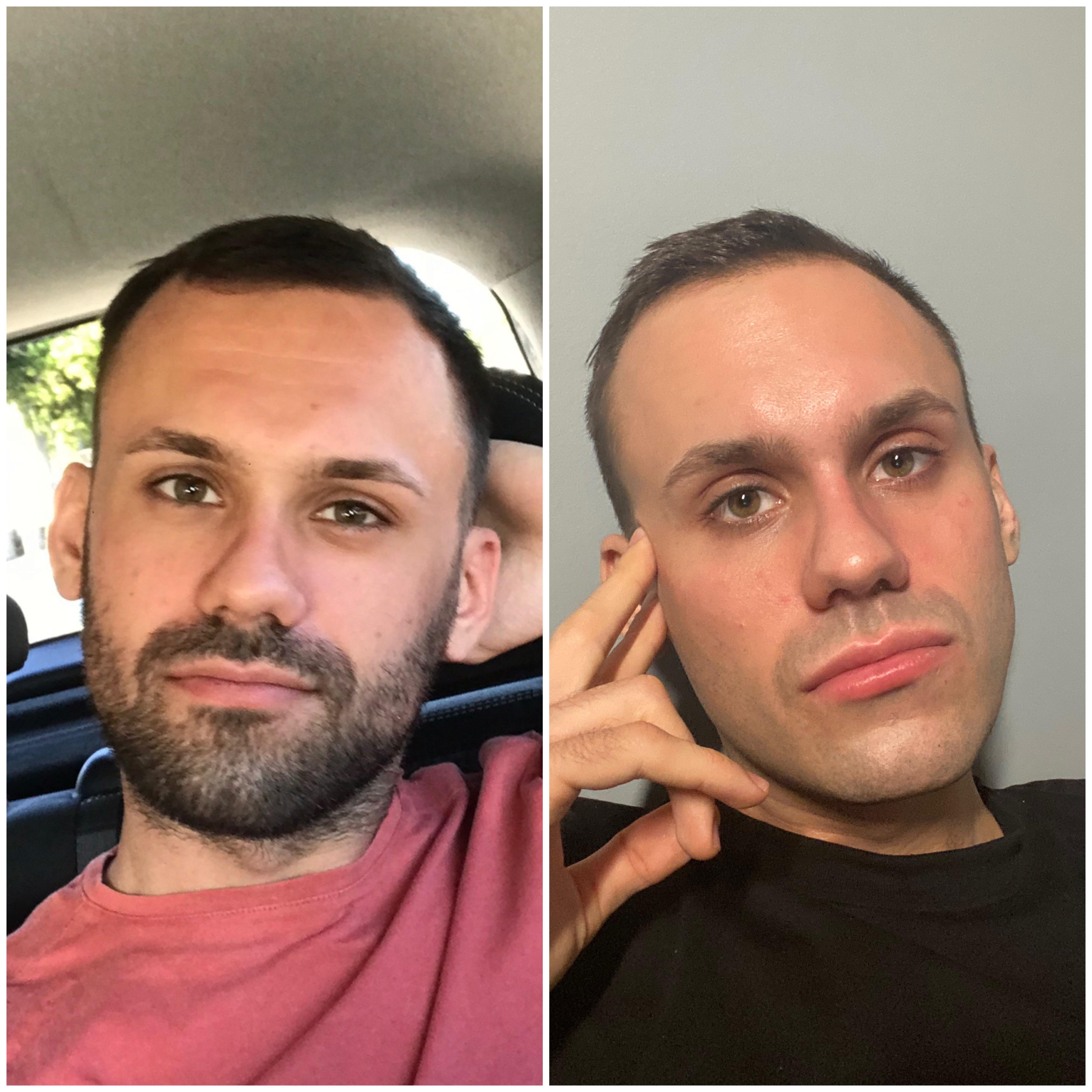 With or without beard? | Scrolller