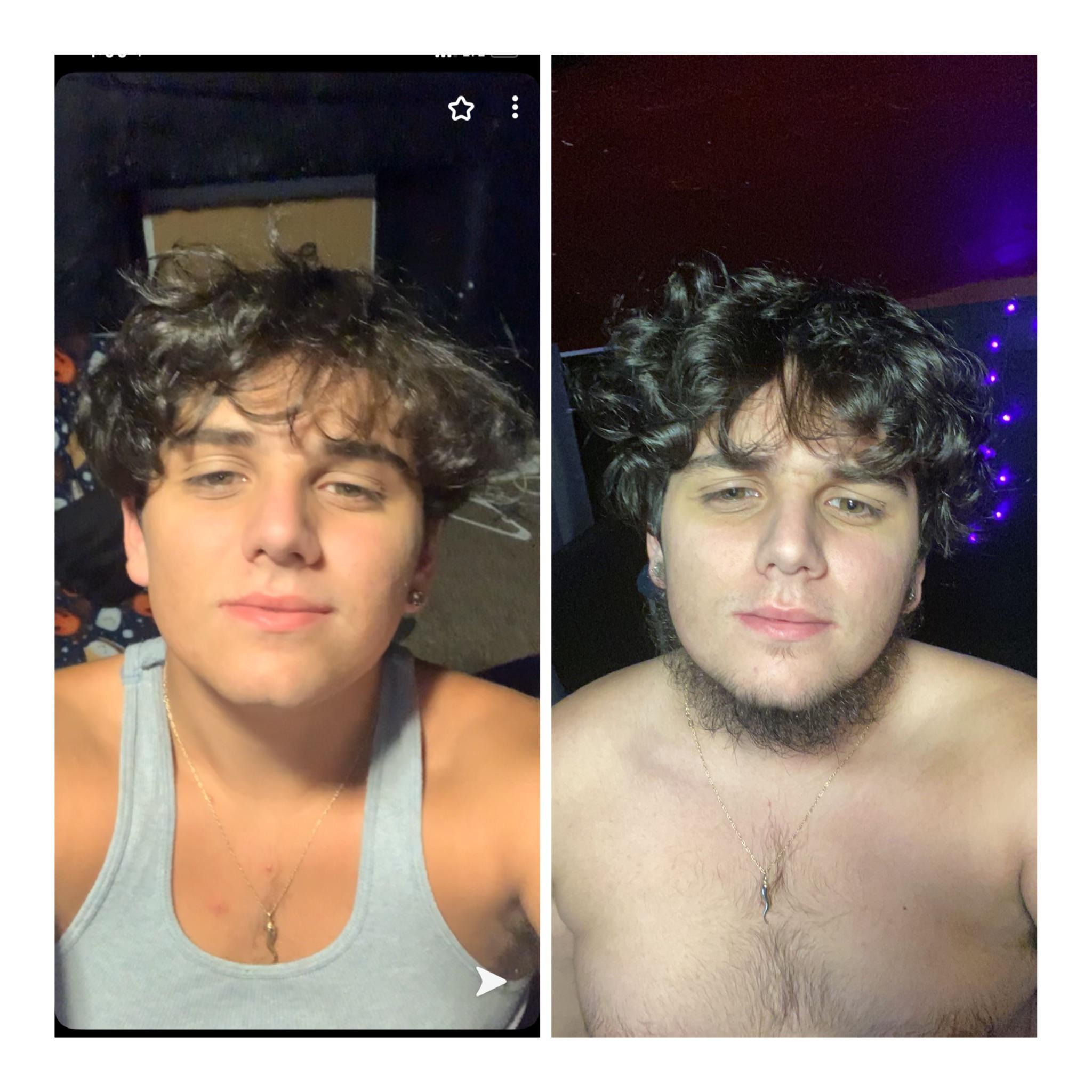 Beard vs no beard? | Scrolller