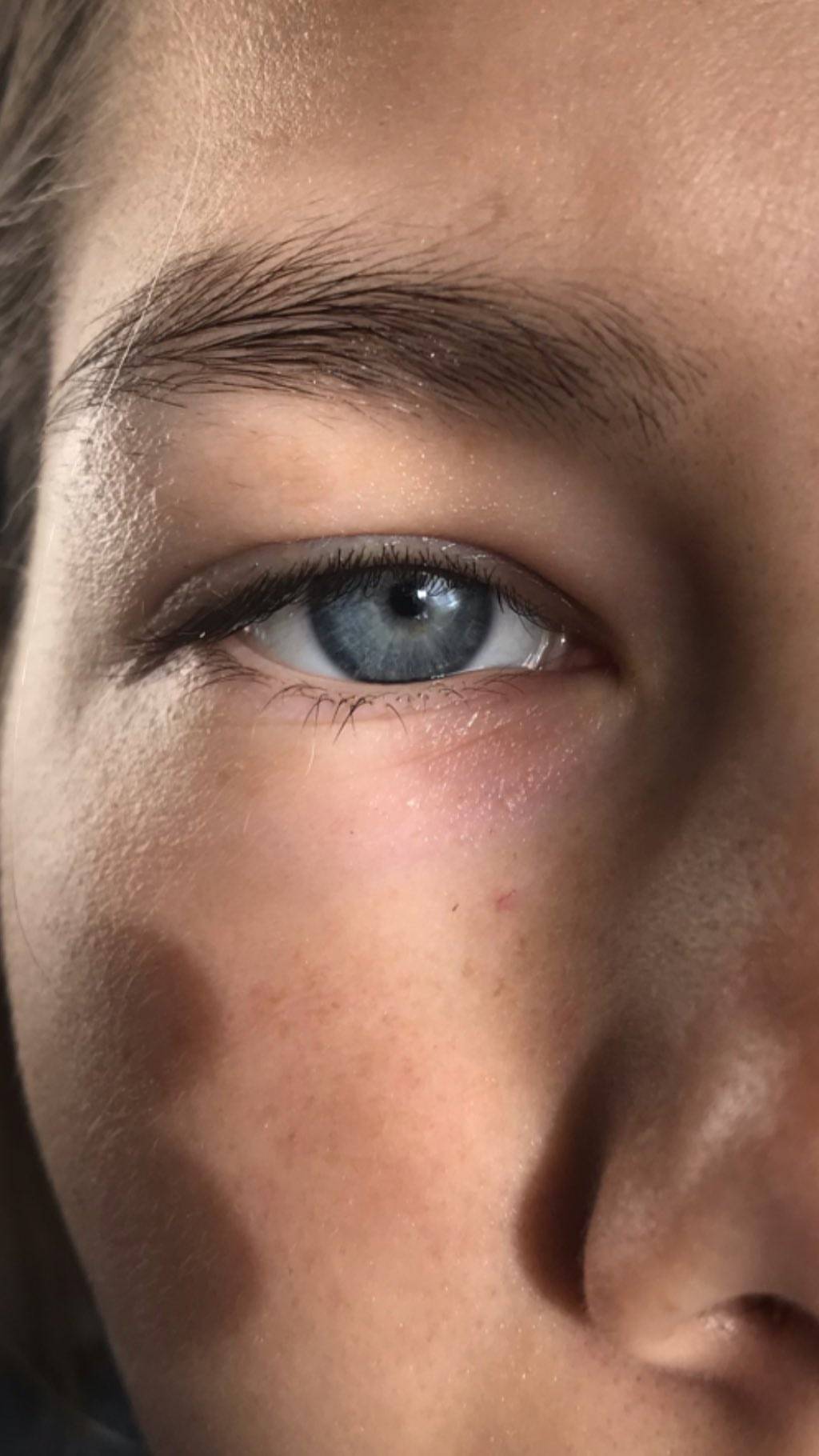 Beautiful Eye | Scrolller