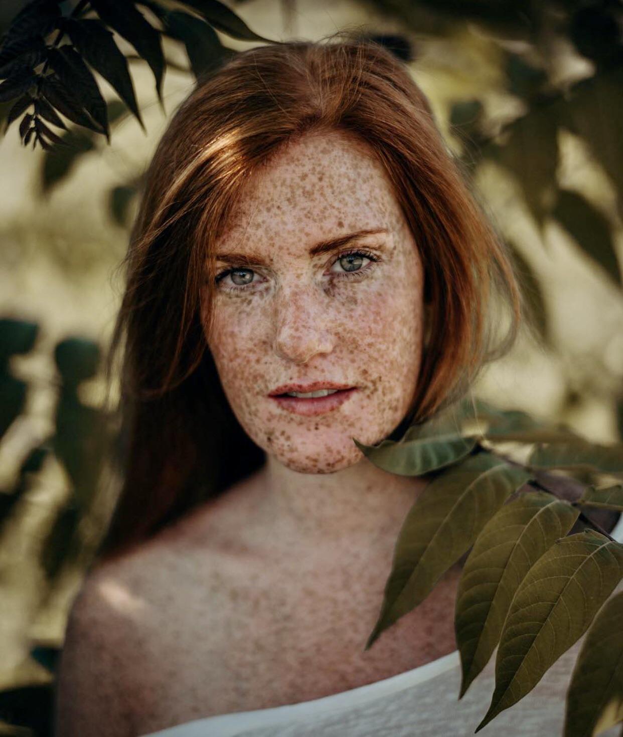 Beautiful Freckled Overload | Scrolller