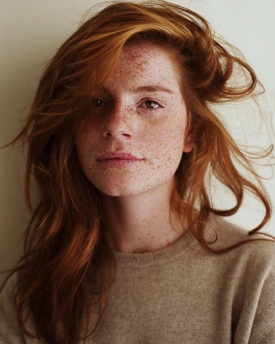 Beautiful freckles | Scrolller