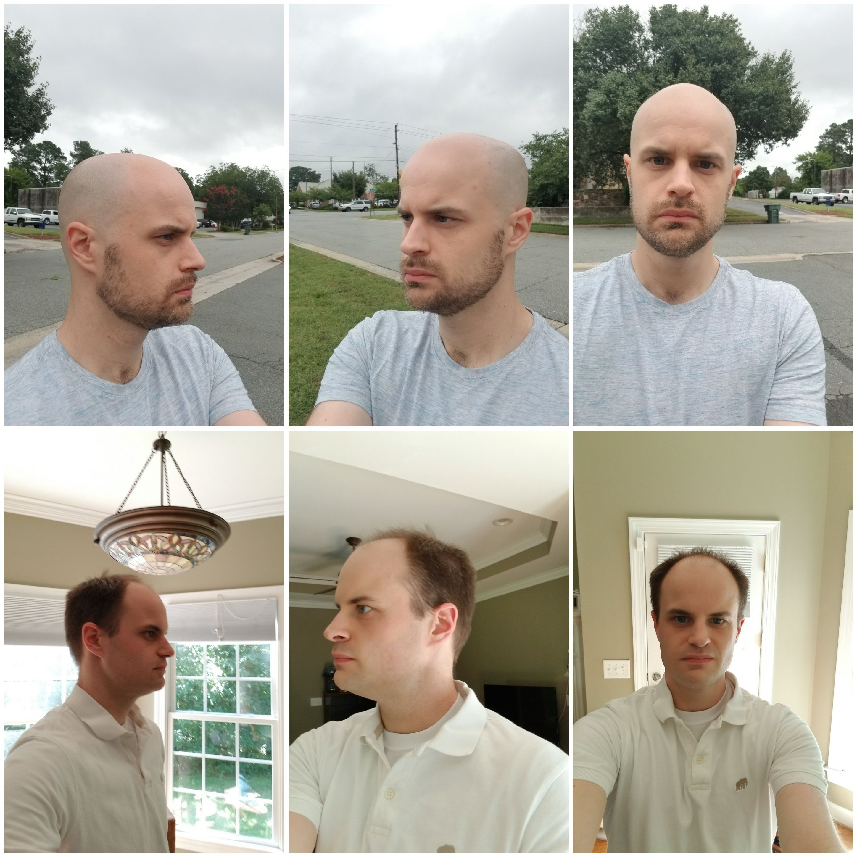 Before/After shots. It feels SO MUCH BETTER! Any tips for the beard ...