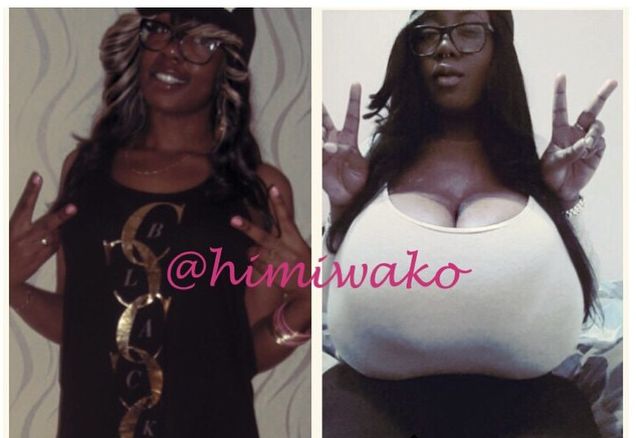 Before and After | Scrolller