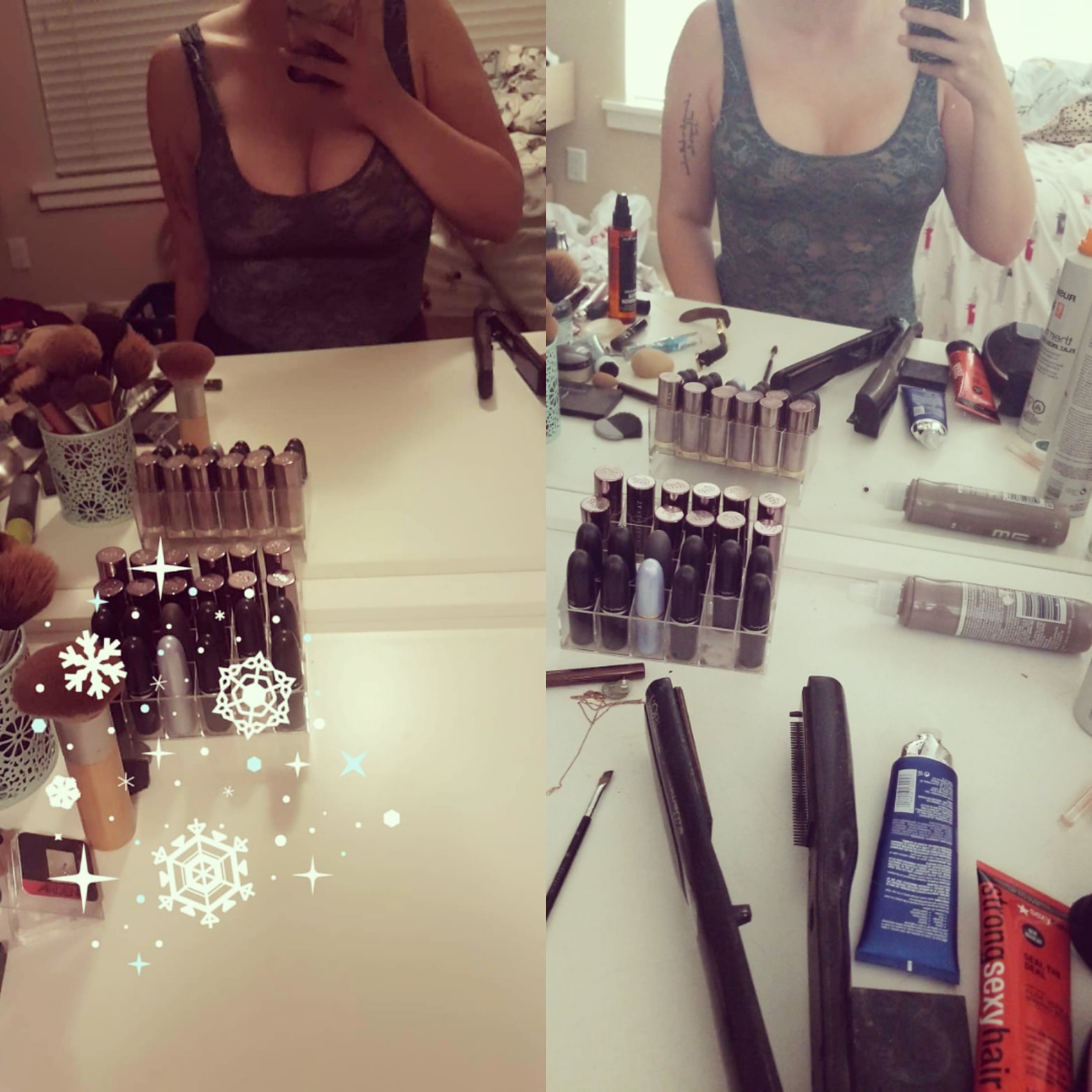 Before and after, 5 days post OP! | Scrolller