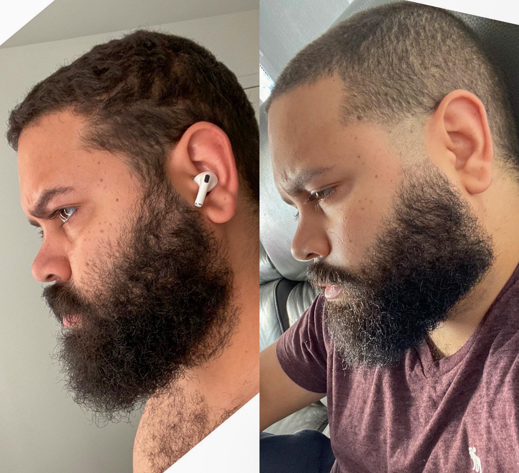 Before and after, self trim. Have to work on the fade. | Scrolller