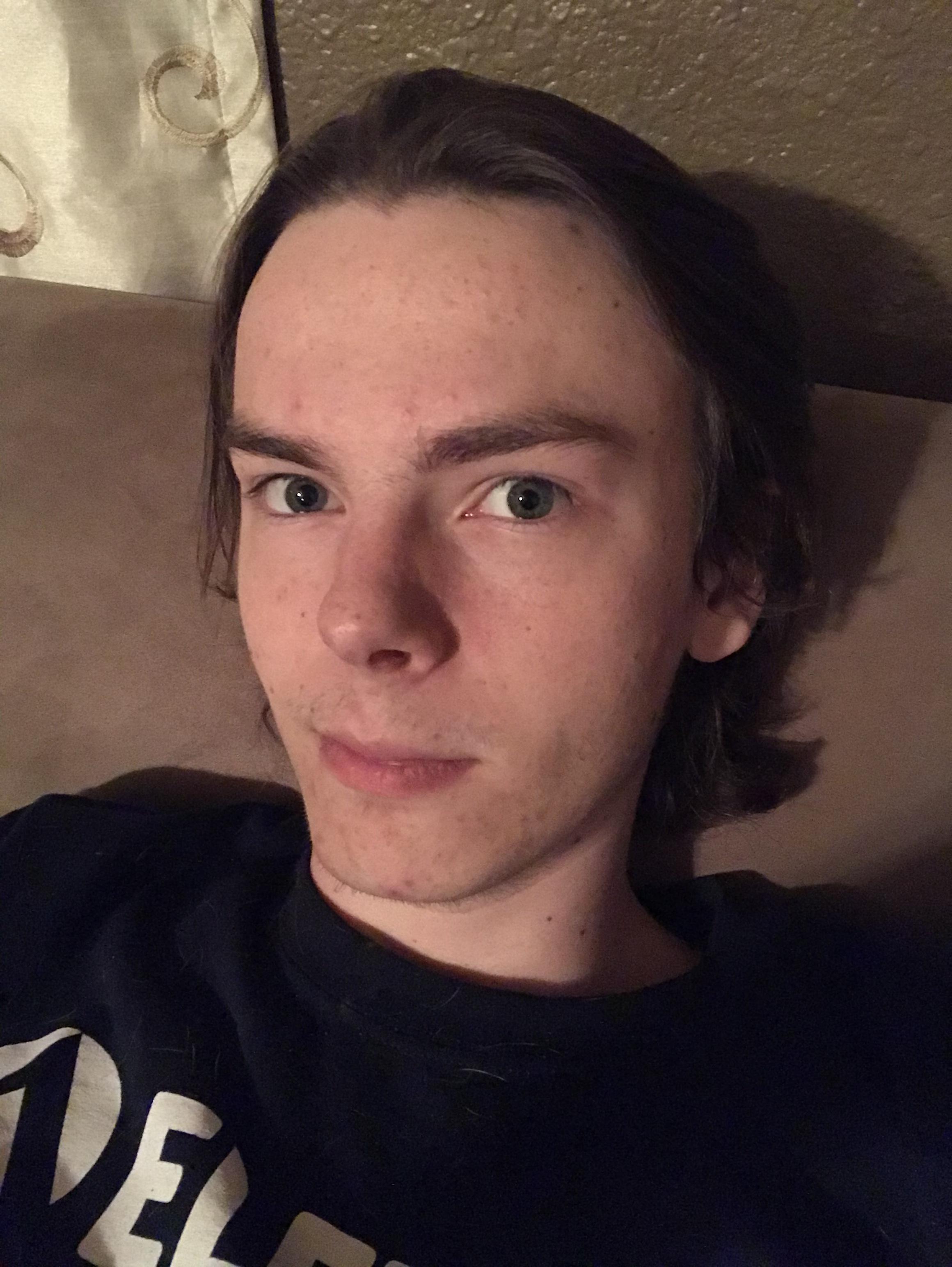 Behold. My horrifying face. I promise I’m not bald my hairs just back. | Scrolller