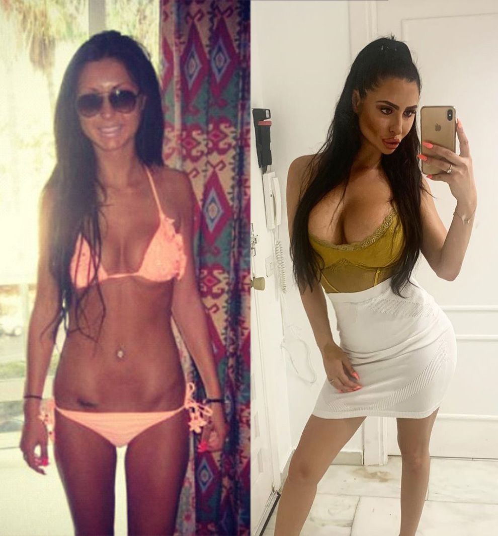 Bethany Grace before and after | Scrolller