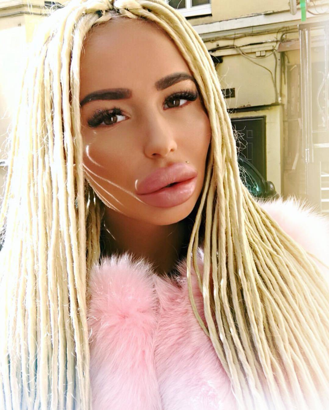 Bimbo Lip Gap | Scrolller