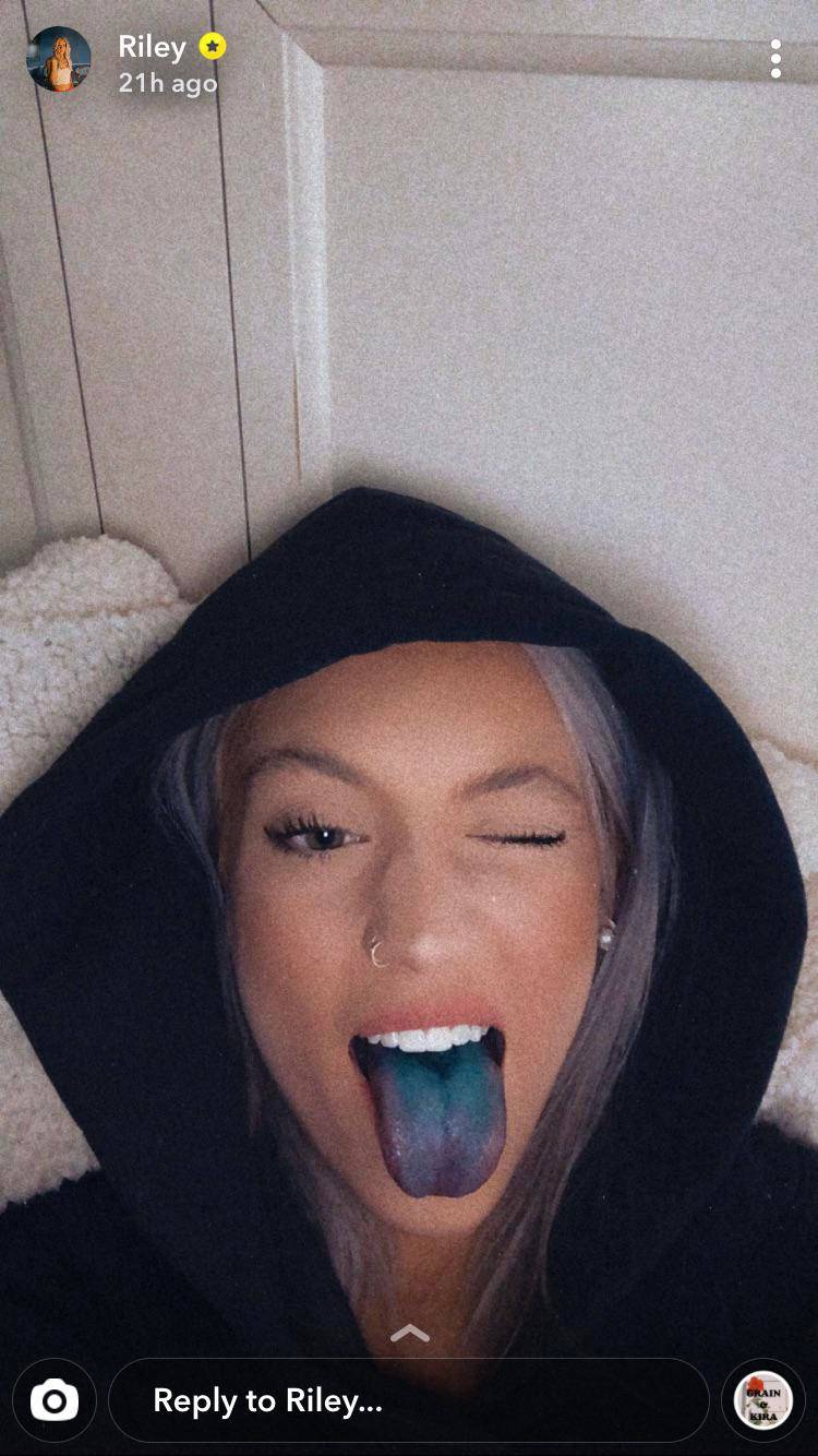 Blue tongue | Scrolller