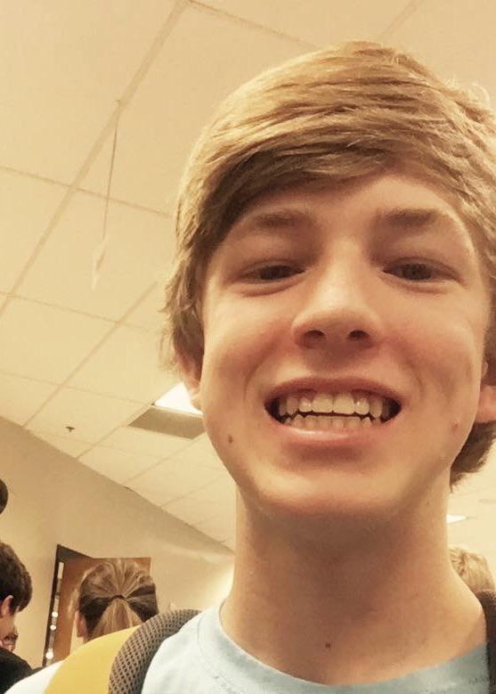 Braces Off Finally Scrolller