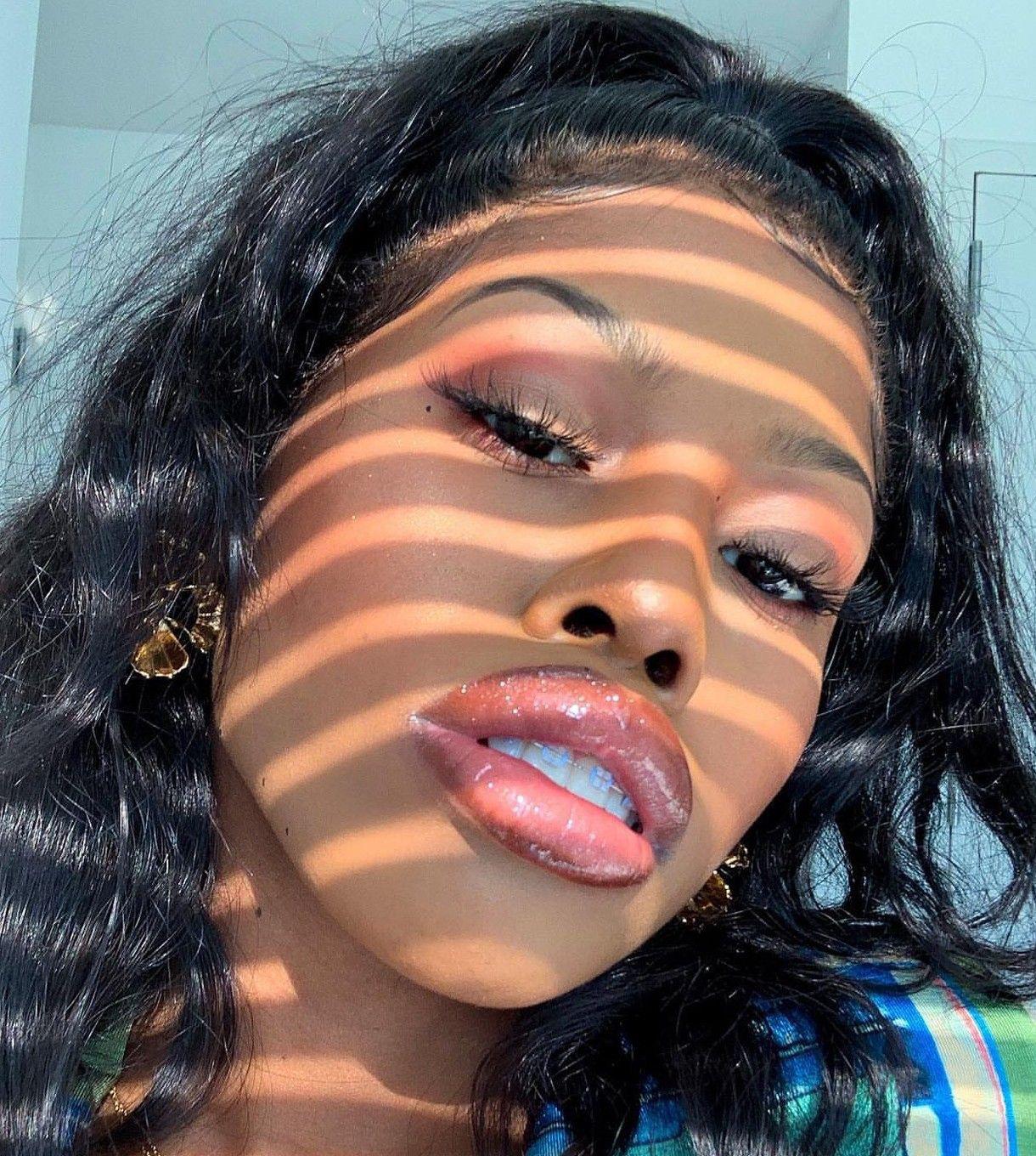 Braces with the gloss | Scrolller