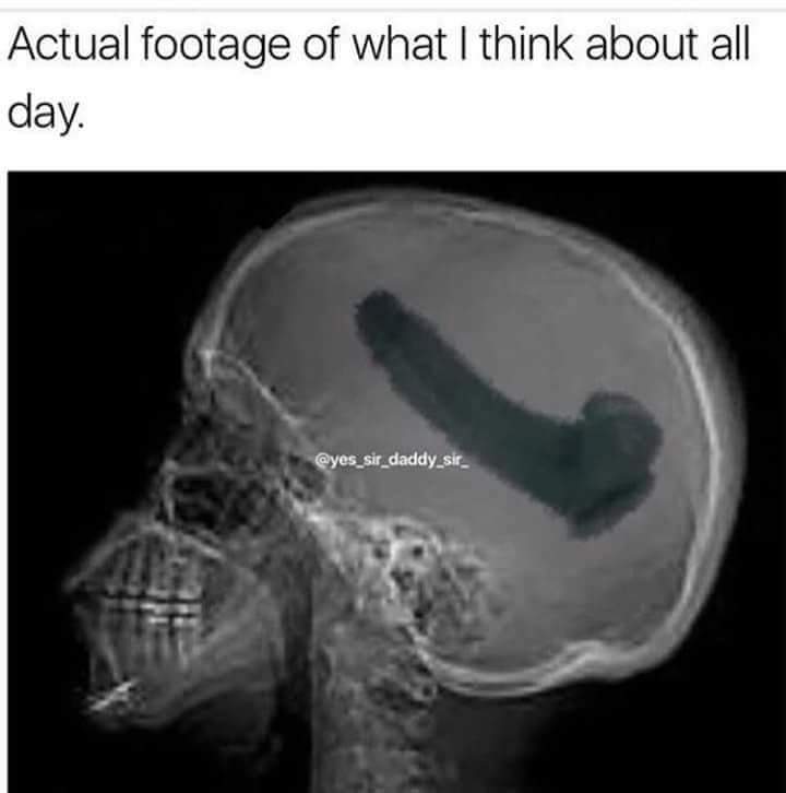 Brain scan | Scrolller