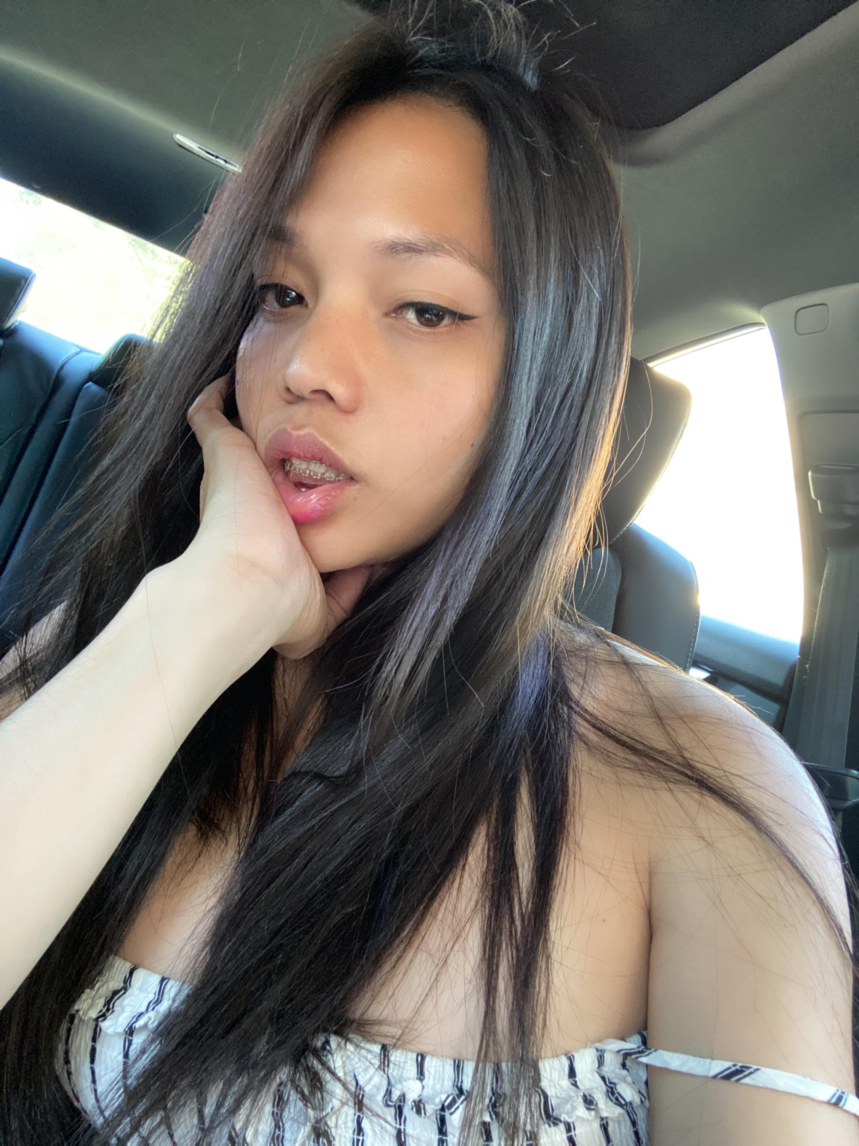 Cant wait to get these braces off.. | Scrolller