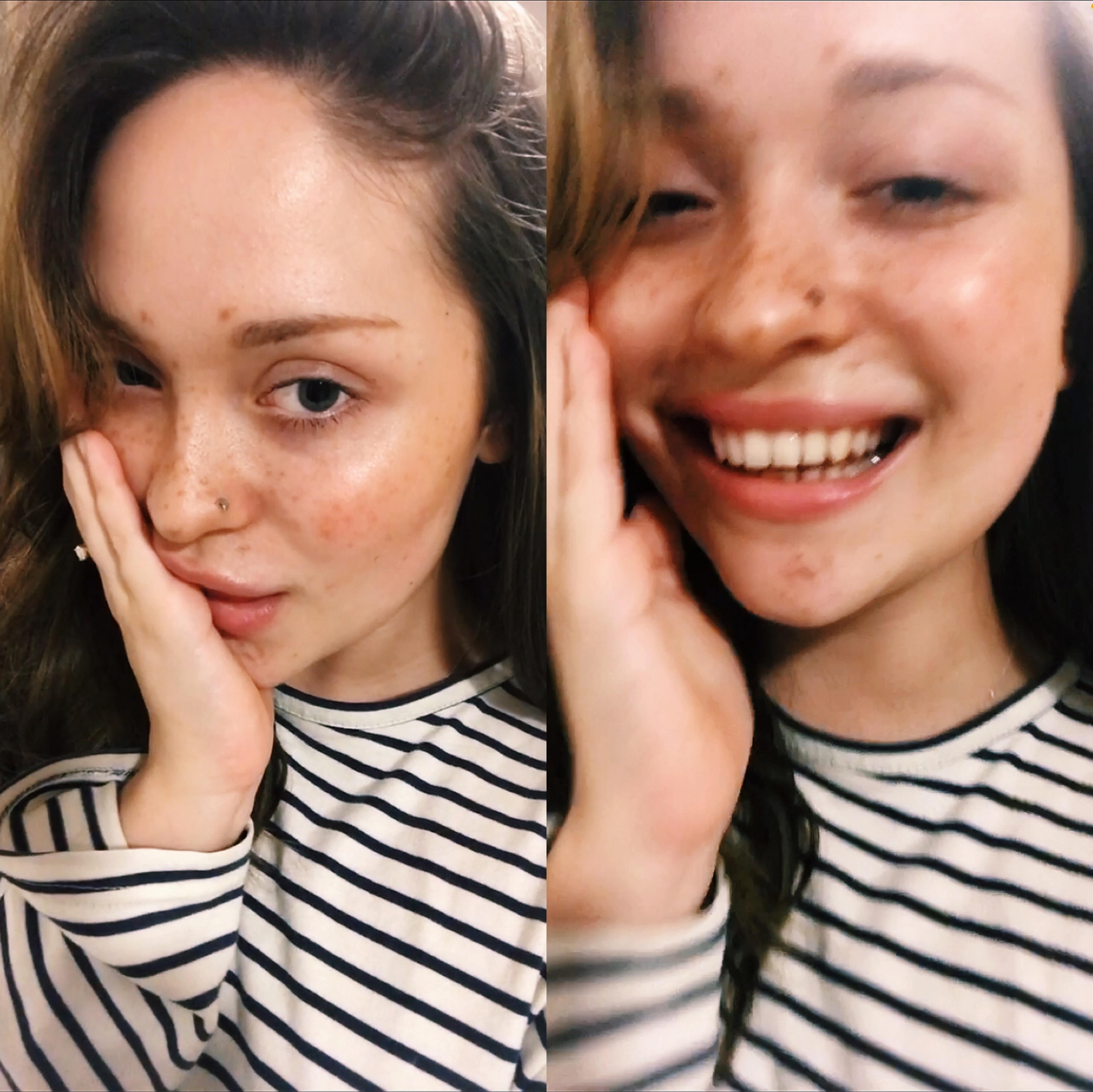 before/after ️ | Scrolller