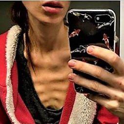 Discover more like Realbonespo: Chest bones and Related Content | Scrolller