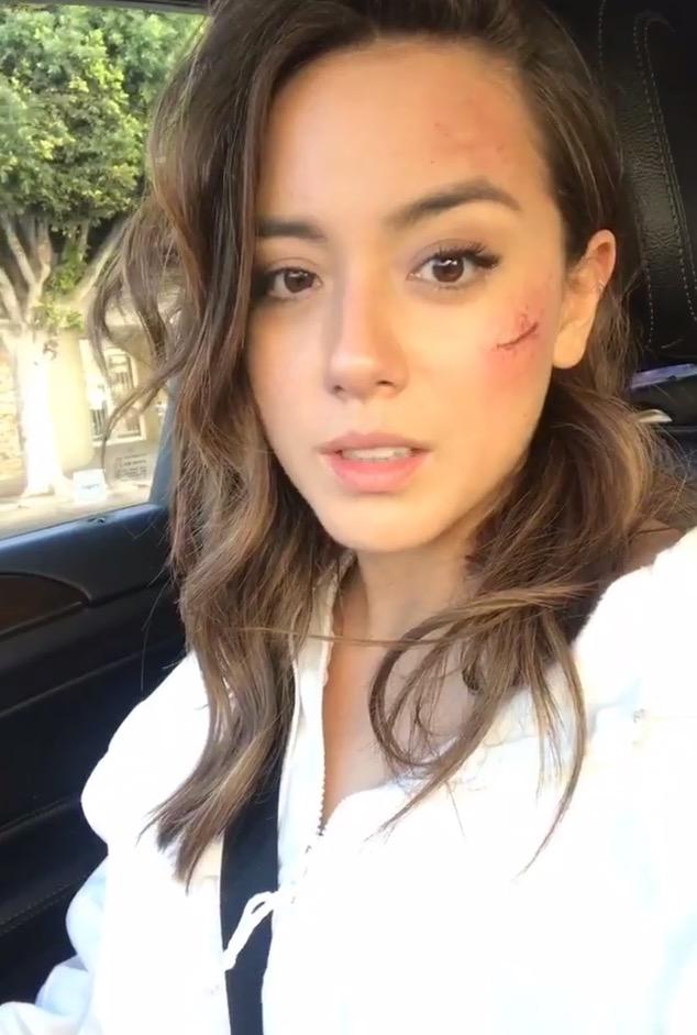 Chloe with a bruise | Scrolller