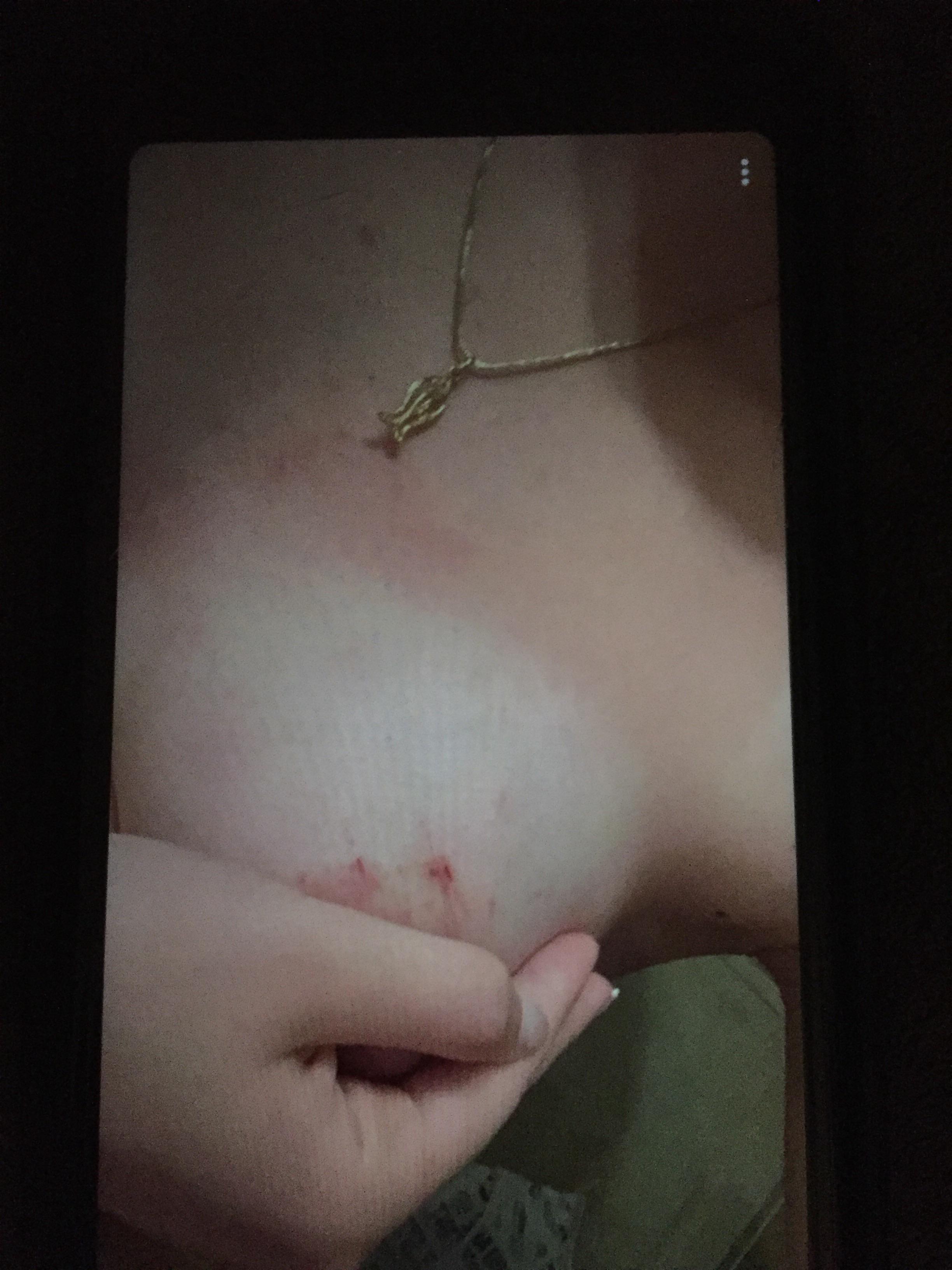 Close up of titty | Scrolller