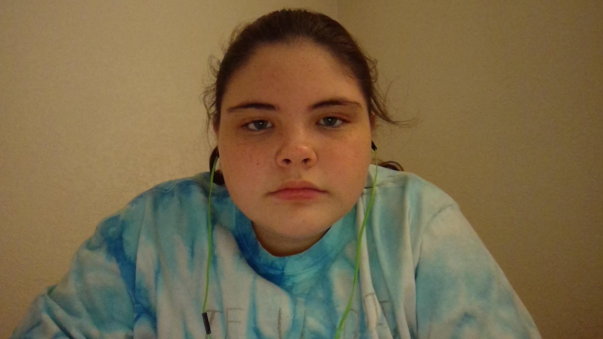 do i have rbf? | Scrolller