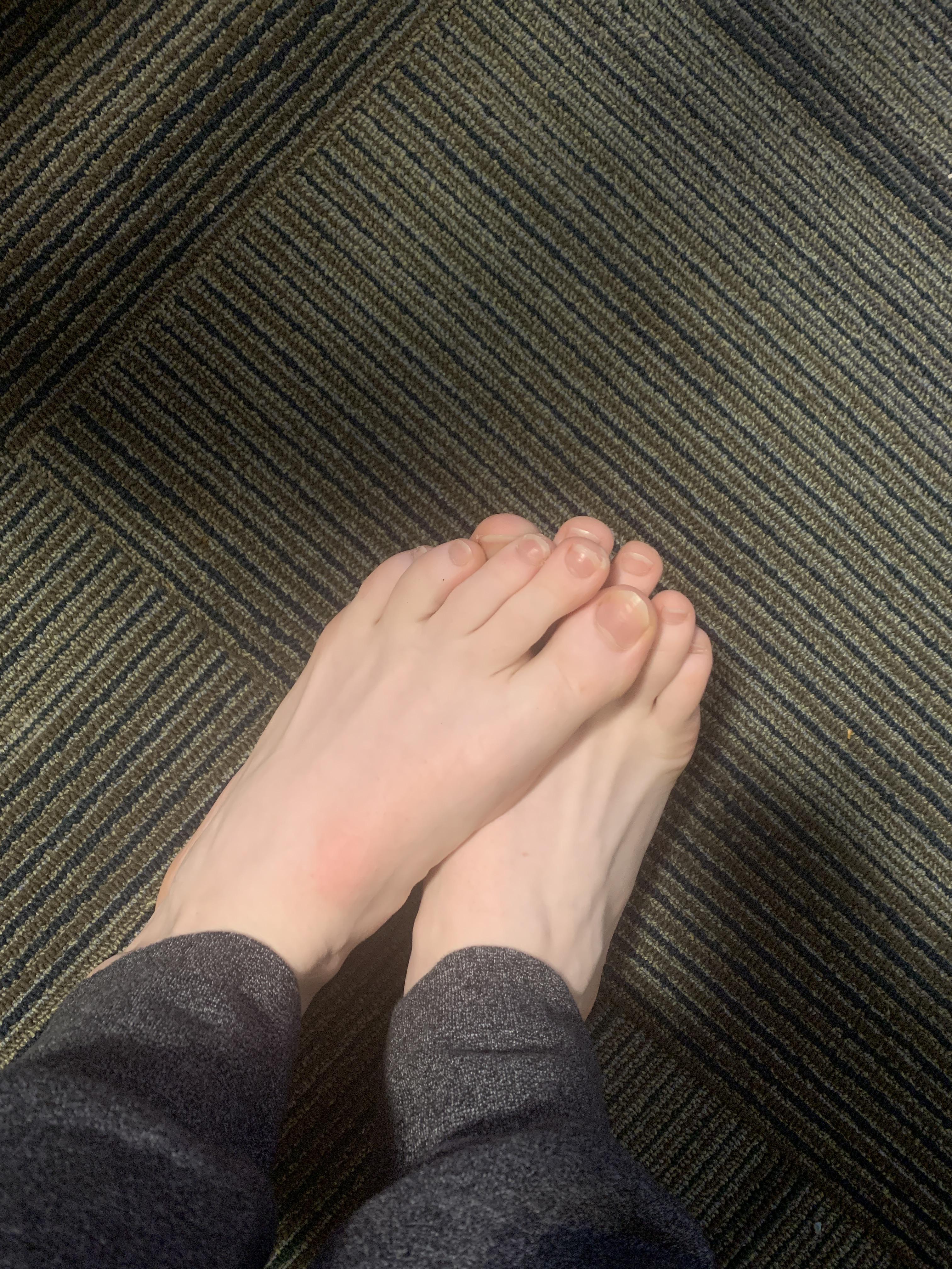 Do You Like My Pale Feet🥺 Scrolller