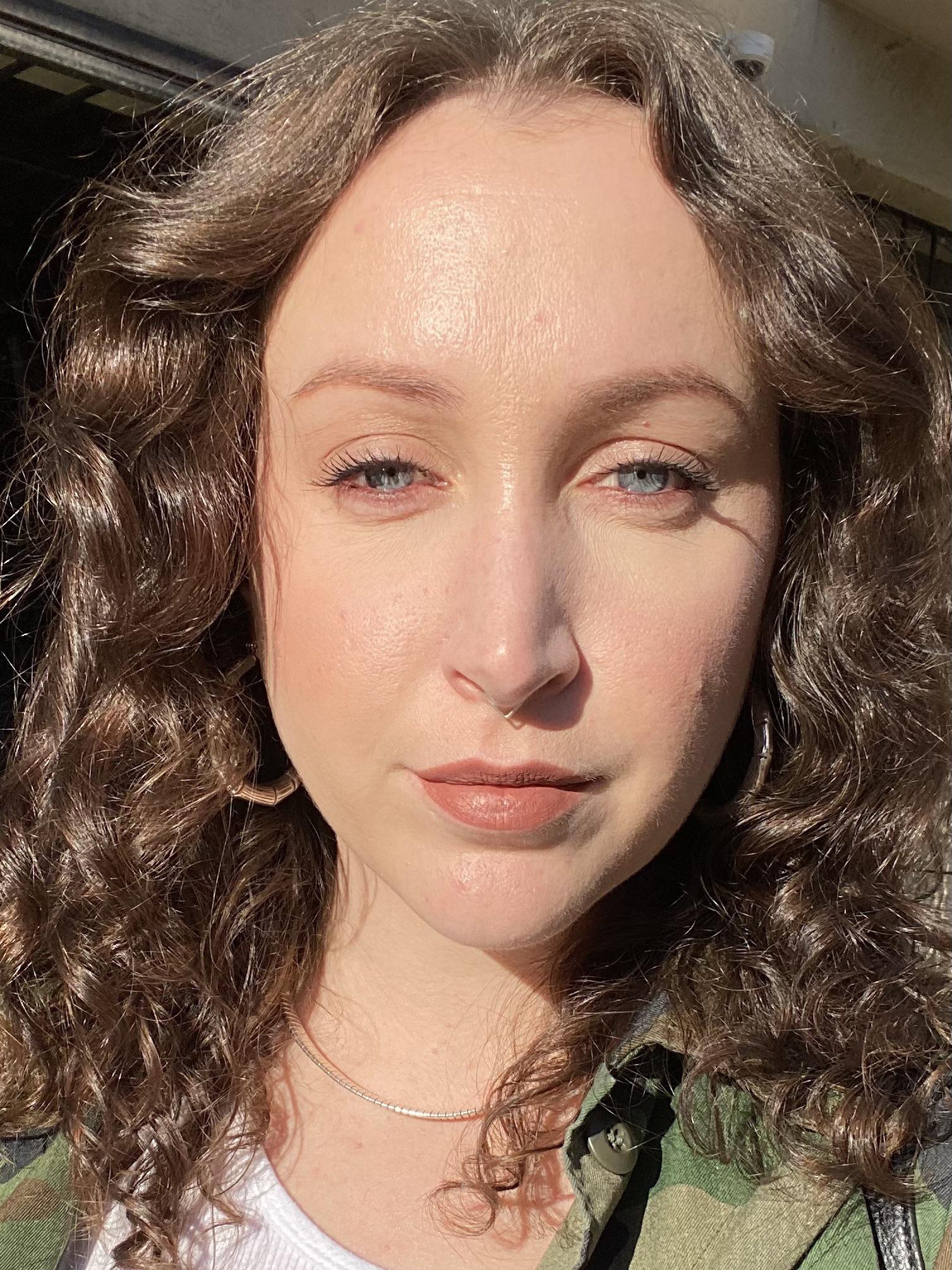 Does my nose look botched? | Scrolller