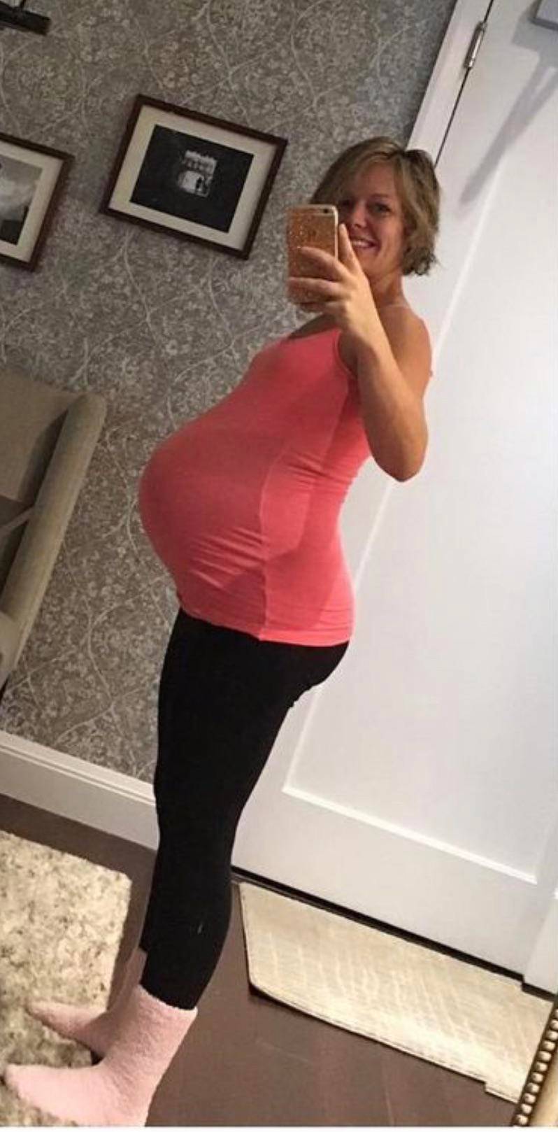 Dylan Dreyer | Scrolller