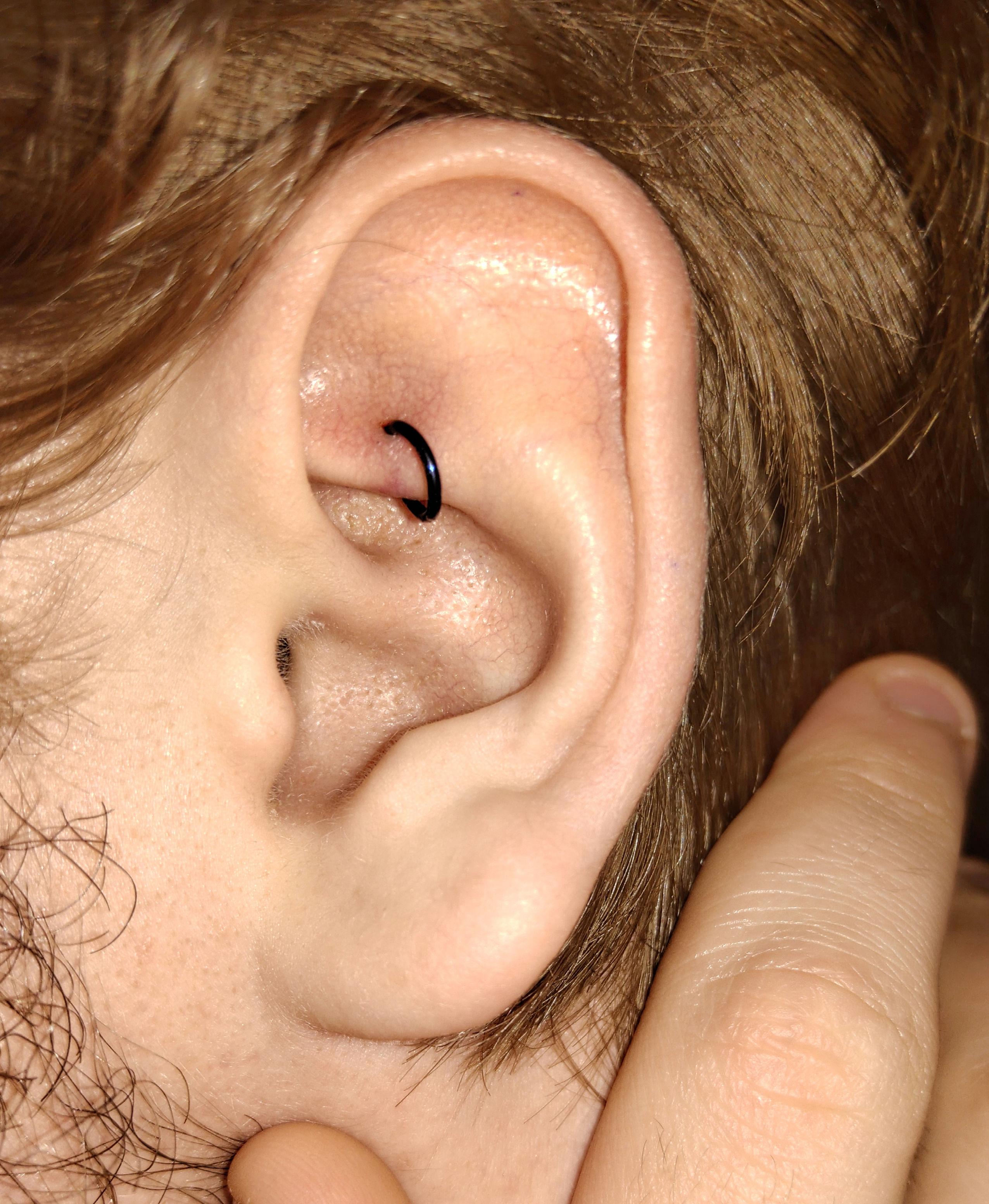 ear | Scrolller
