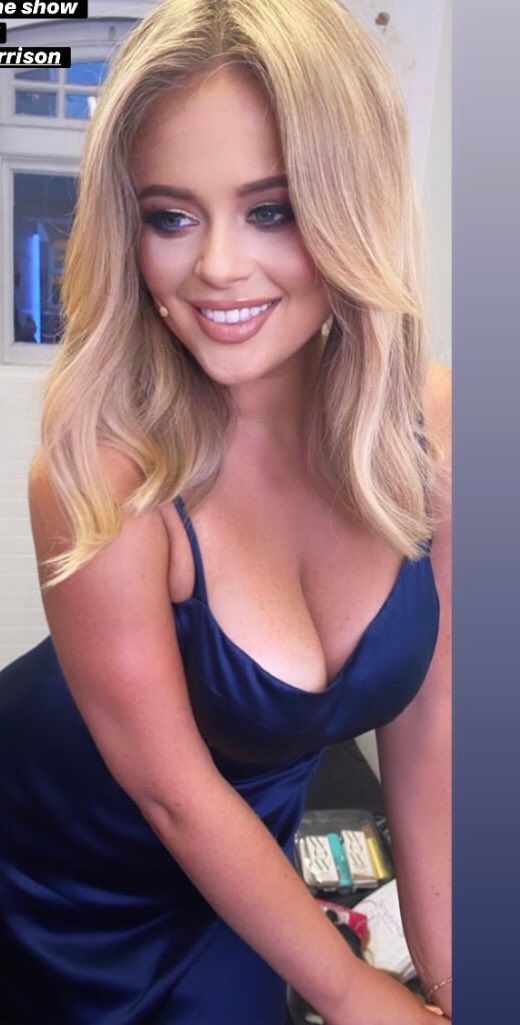 Emily Atack OMG | Scrolller